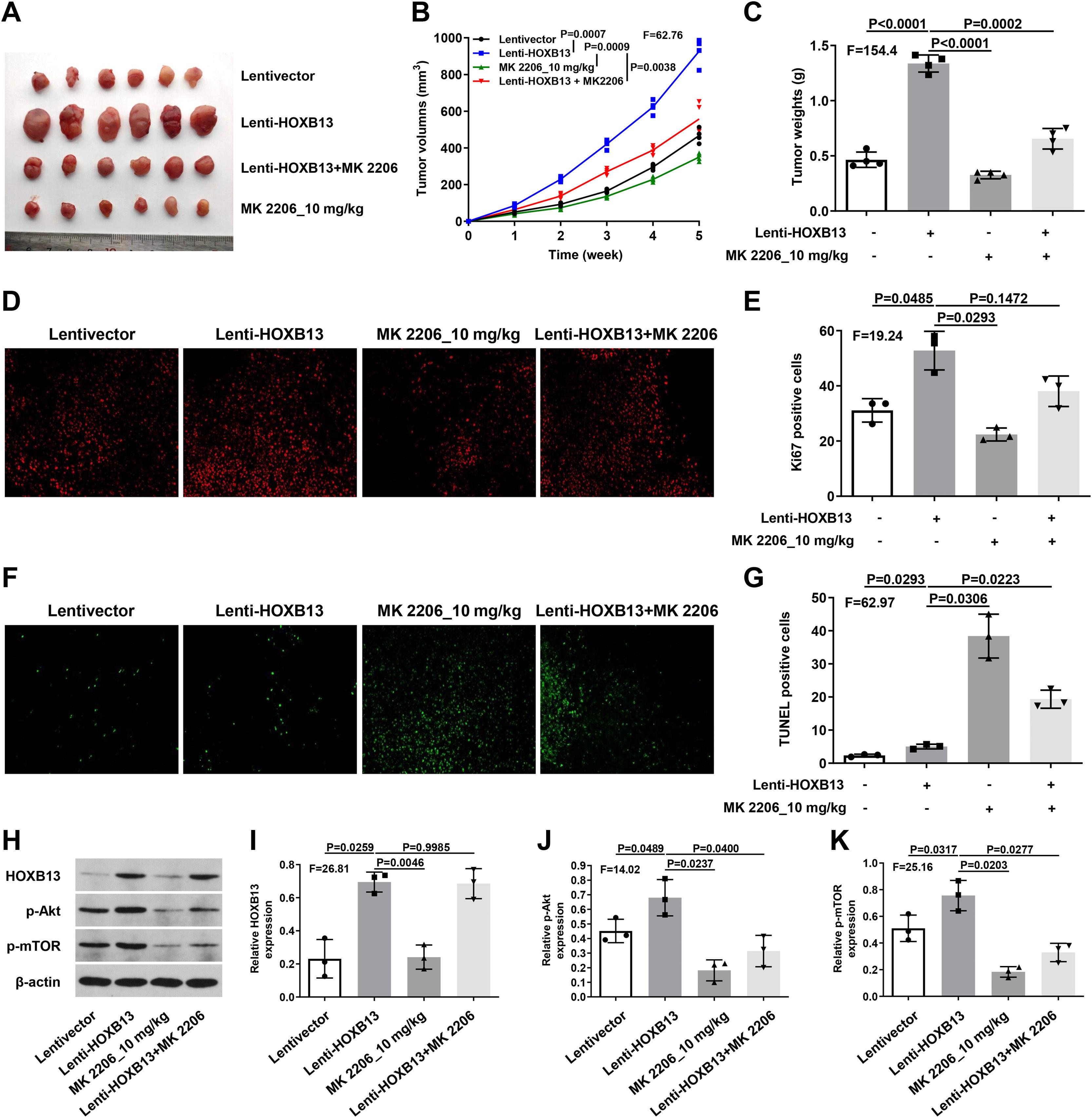 HOXB13 facilitates hepatocellular carcinoma progression by activating ...