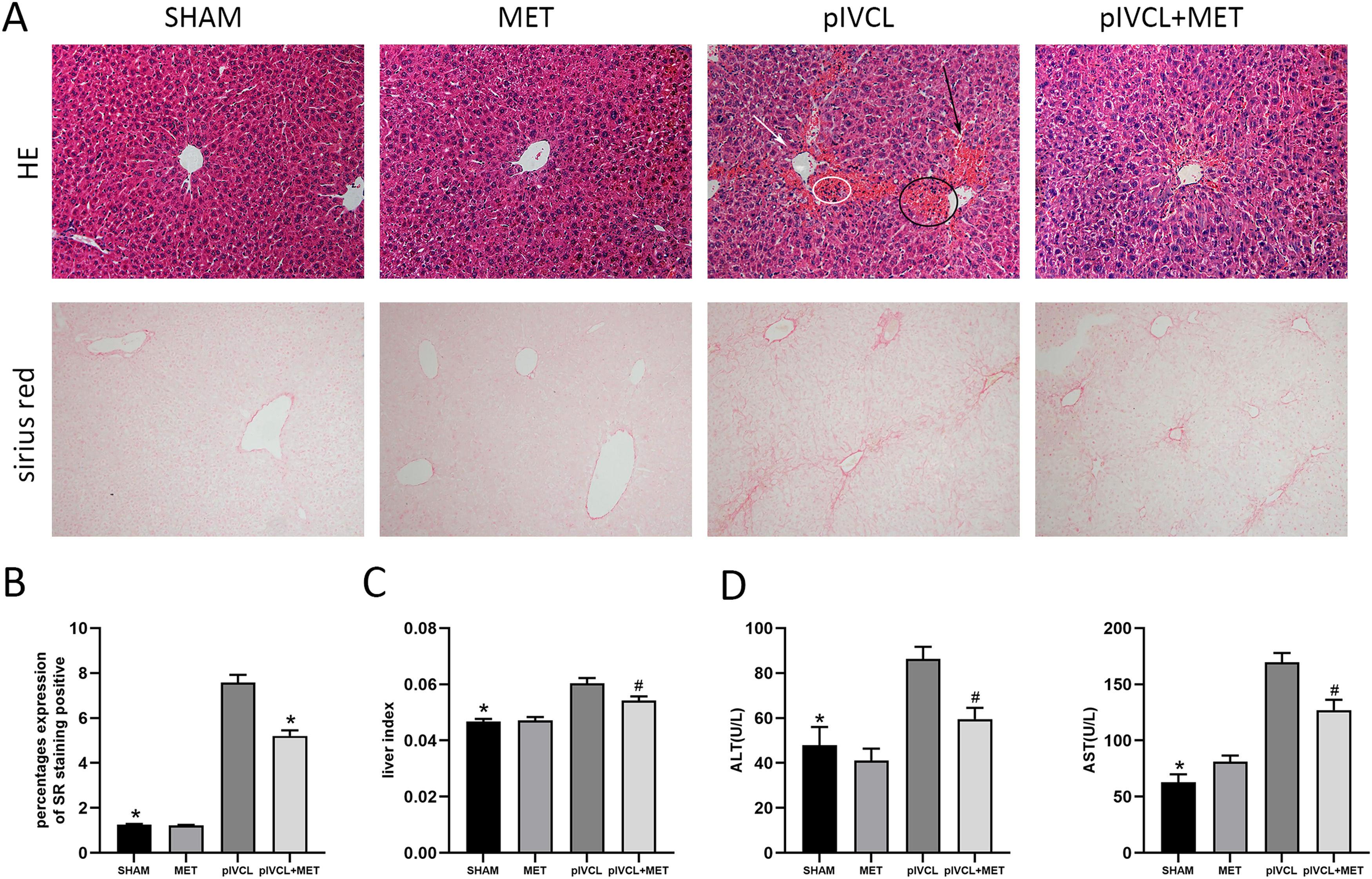 Metformin ameliorates liver fibrosis induced by congestive hepatopathy ...
