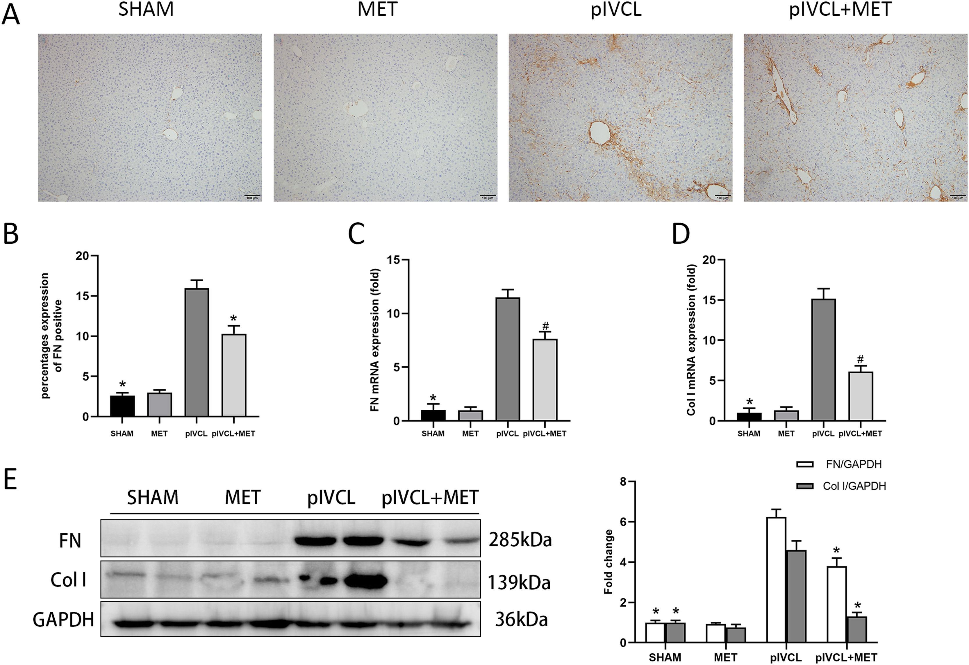 Metformin ameliorates liver fibrosis induced by congestive hepatopathy ...