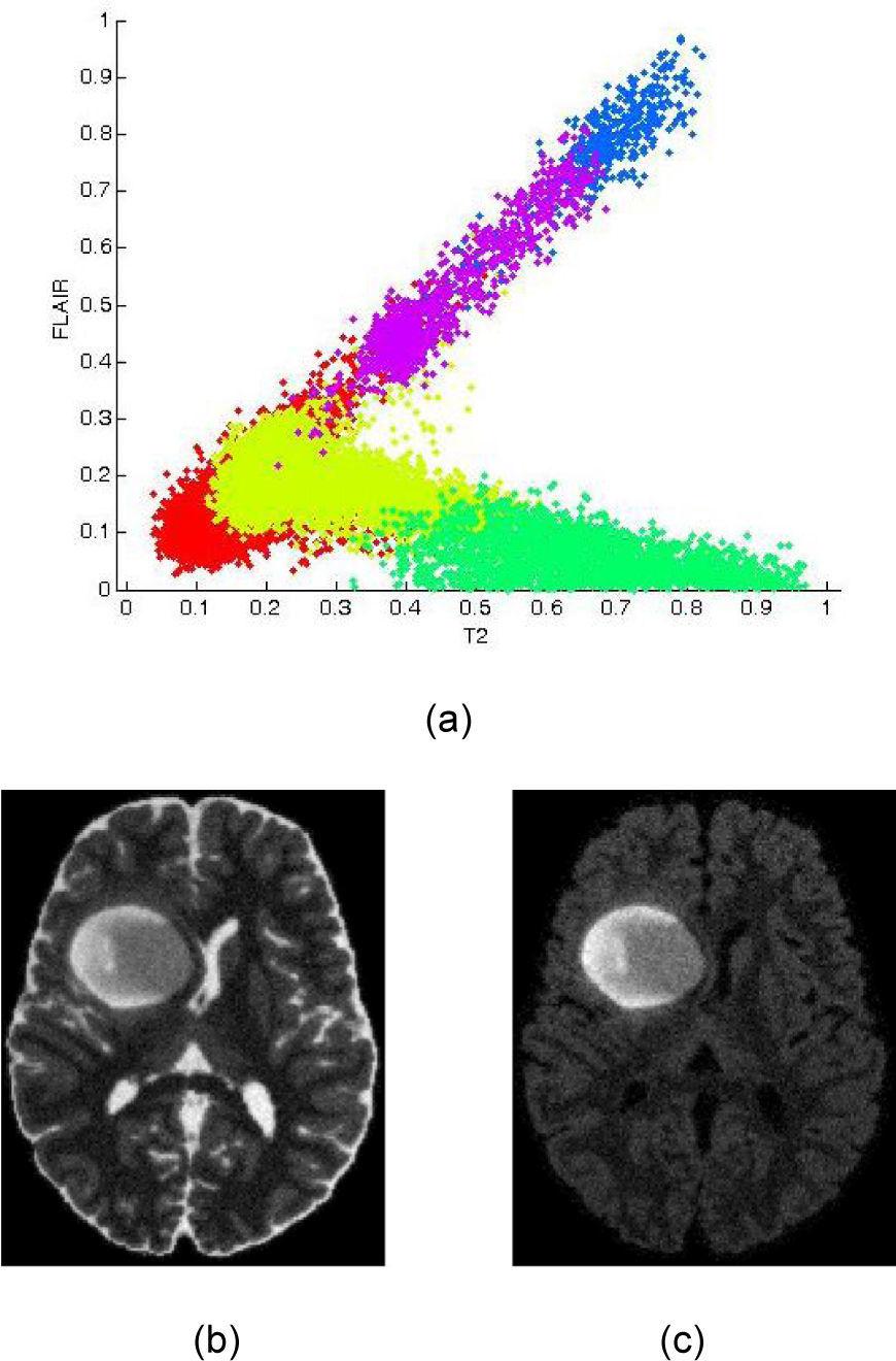 Automated Multi-Contrast Brain Pathological Area Extraction from 2D MR ...