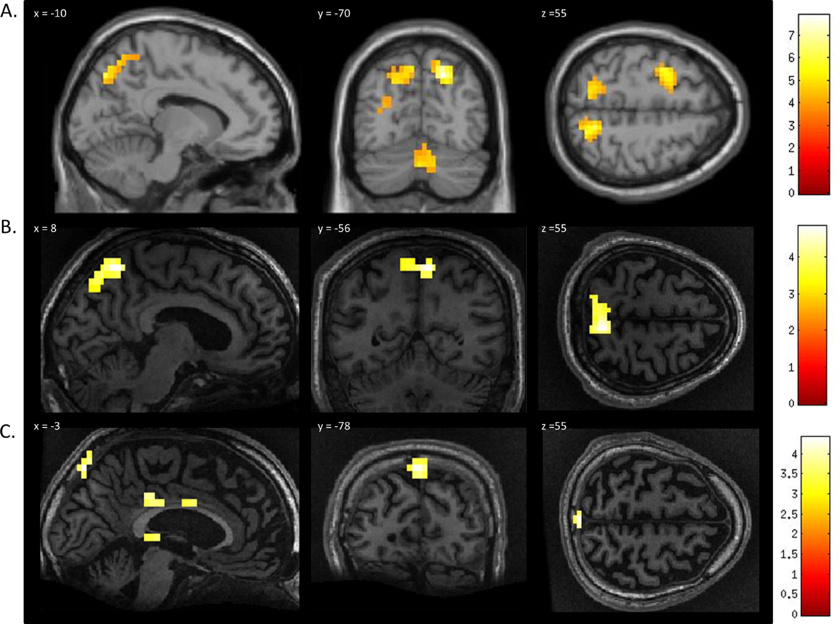 Use of functional magnetic resonance imaging to assess cognition and ...