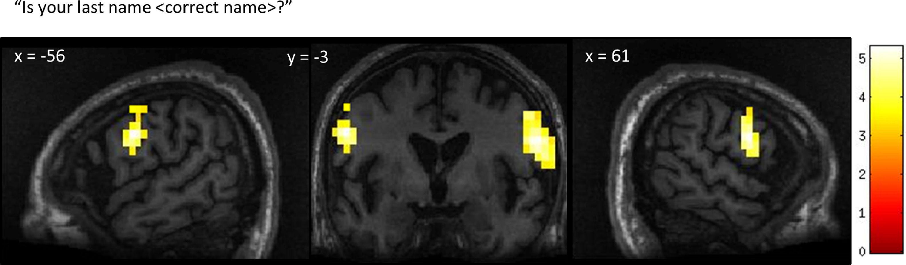 Use of functional magnetic resonance imaging to assess cognition and ...