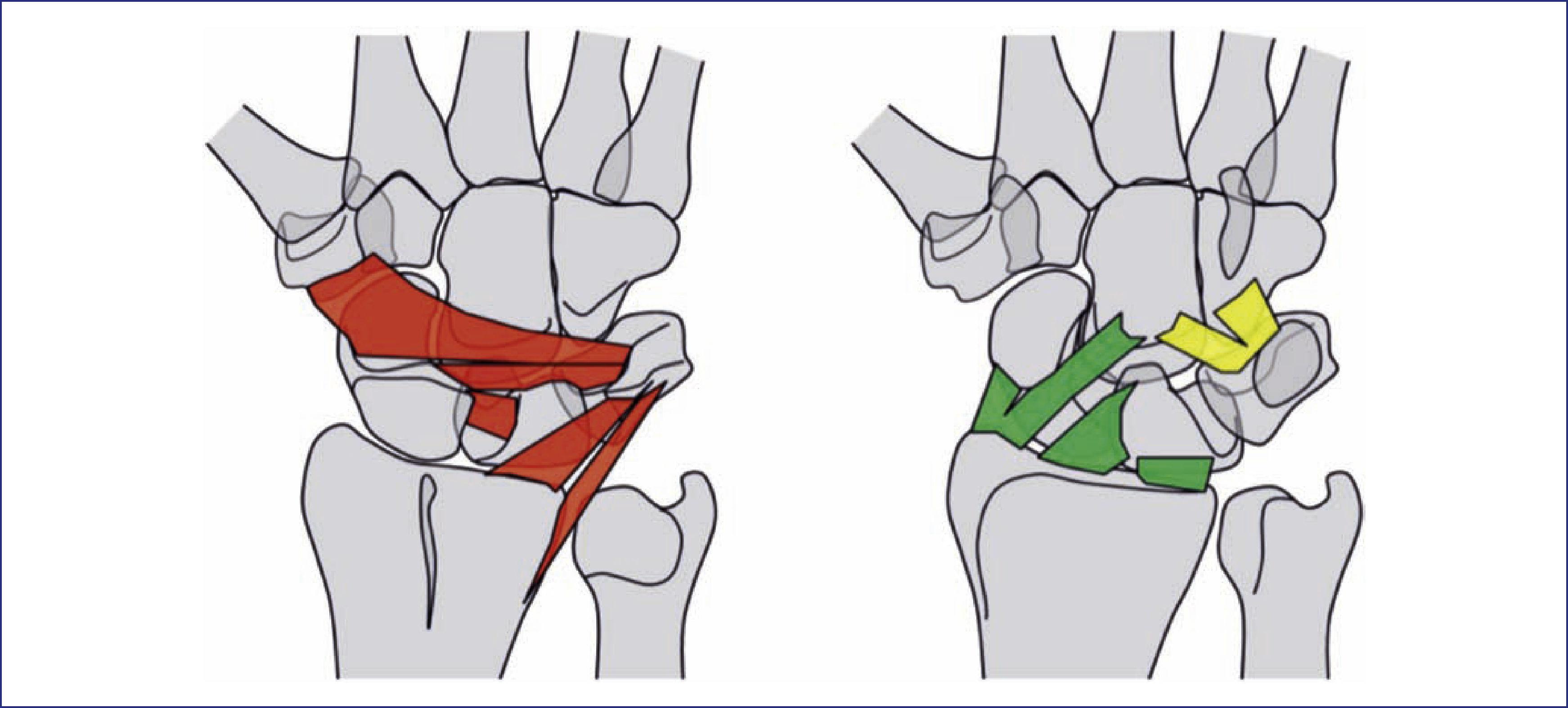 El papel de la propiocepción y el control neuromuscular en las ...