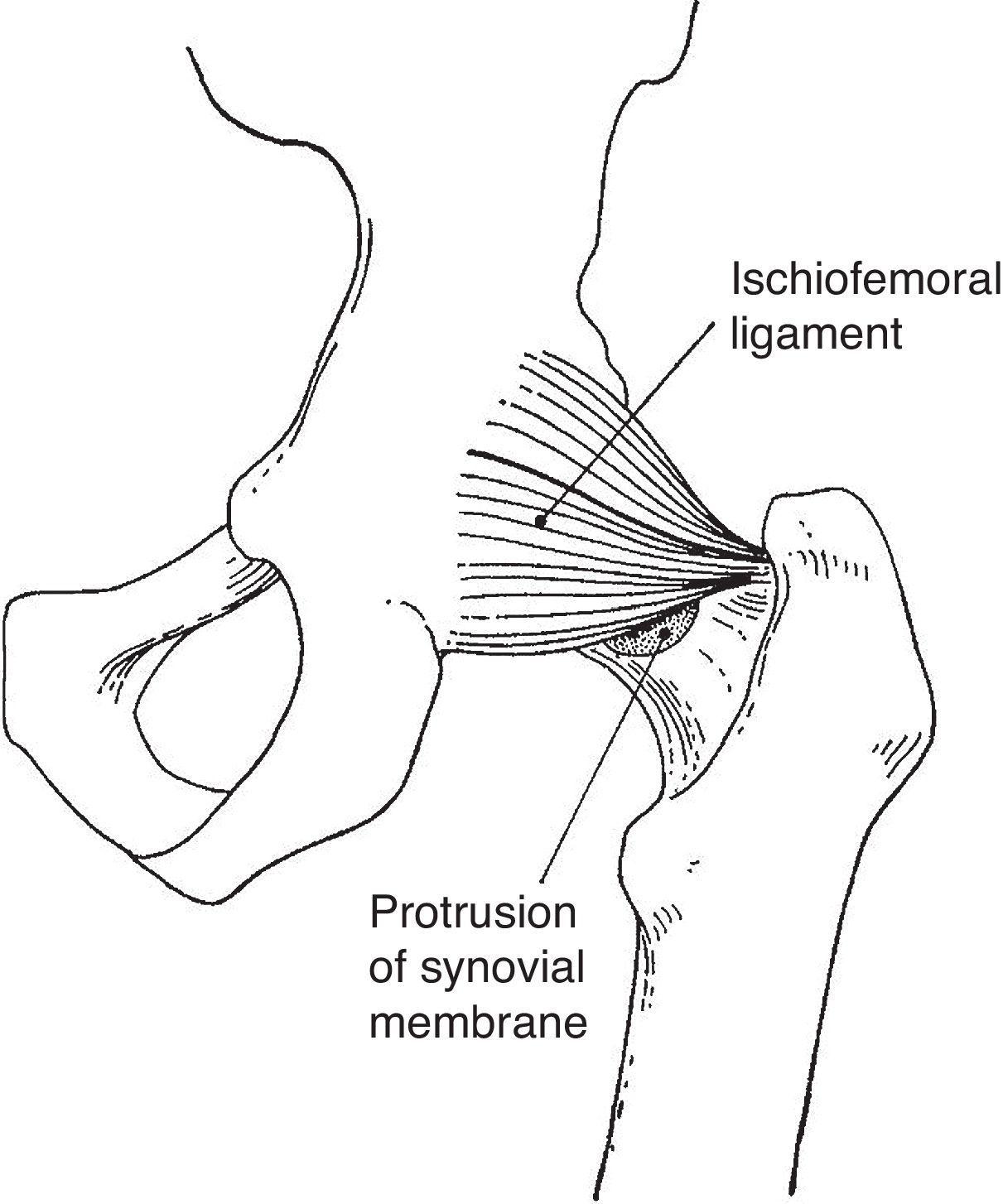 Clinical Anatomy of the Pelvis and Hip | Reumatología Clínica