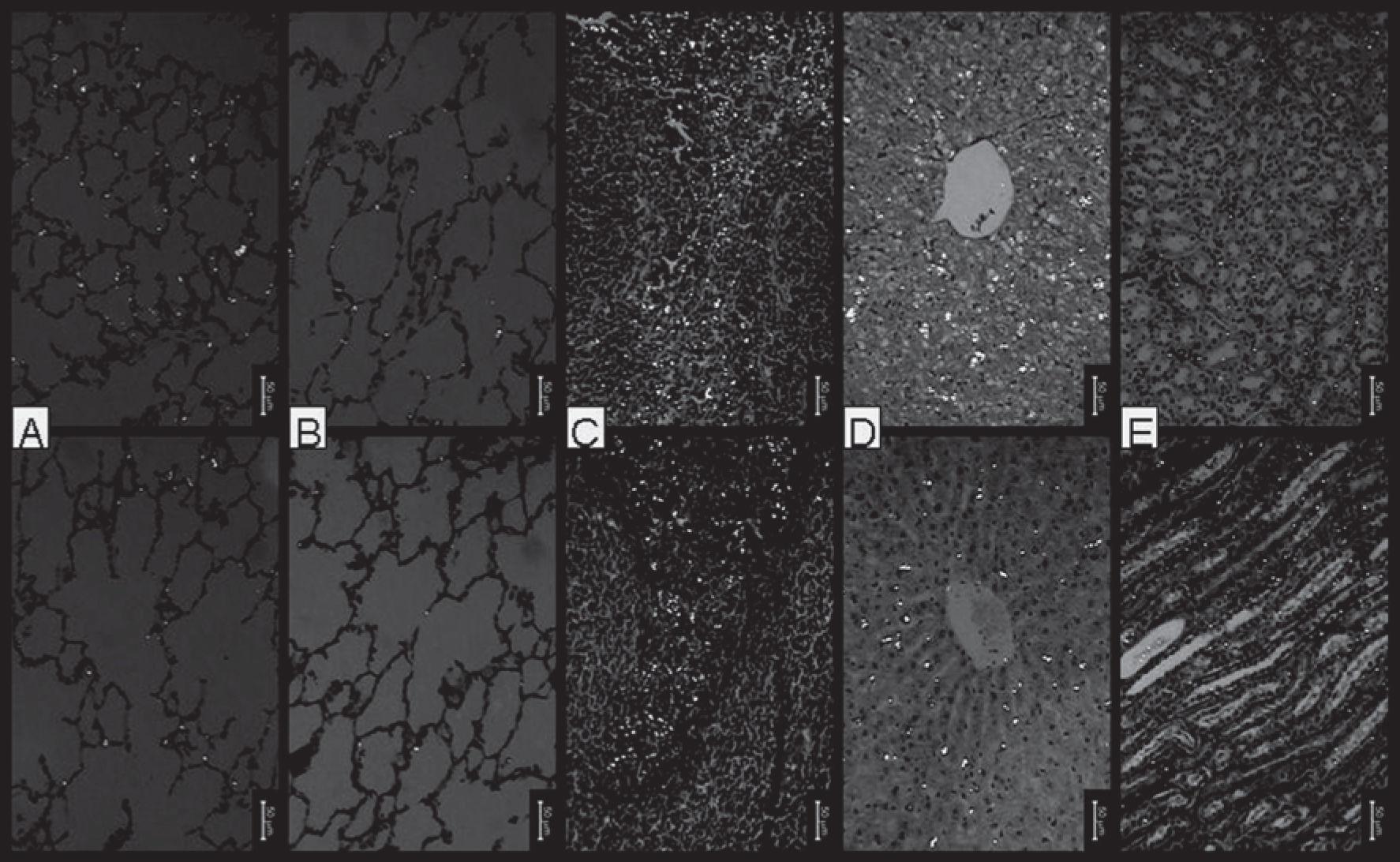 INFLAMMATION AND CLINICAL REPERCUSSIONS OF PLEURODESIS INDUCED BY ...
