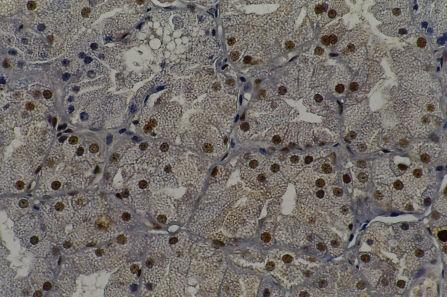 The effects of antidepressants and pilocarpine on rat parotid glands ...