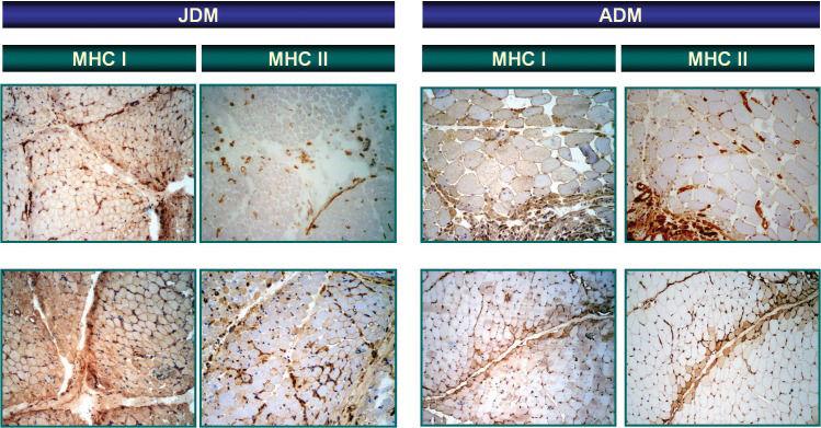 Skeletal muscle major histocompatibility complex class I and II ...
