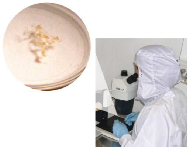 An update on sperm retrieval techniques for azoospermic males | Clinics