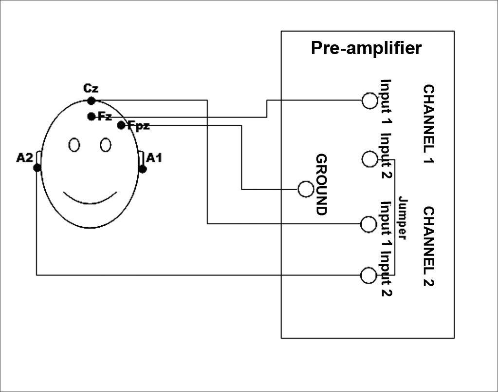 P300- long-latency auditory evoked potential in normal hearing subjects ...