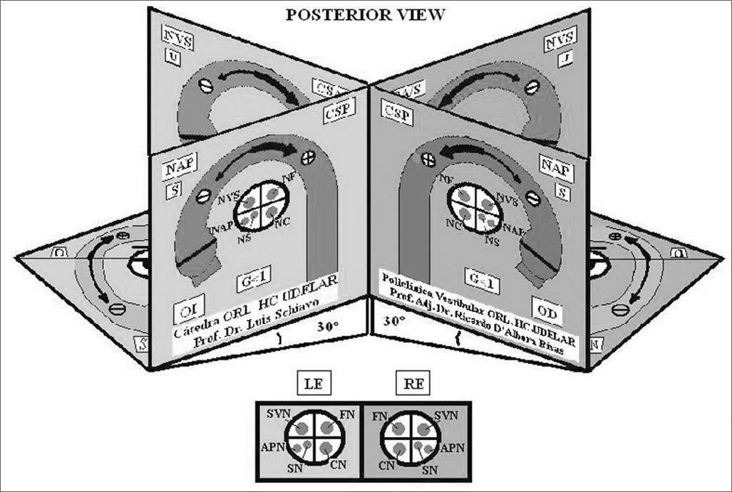 3D didactic model and useful guide of the semicircular conducts ...