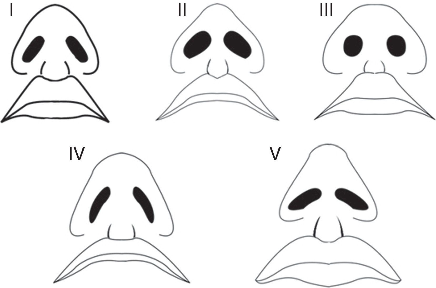 African American Nose Shapes