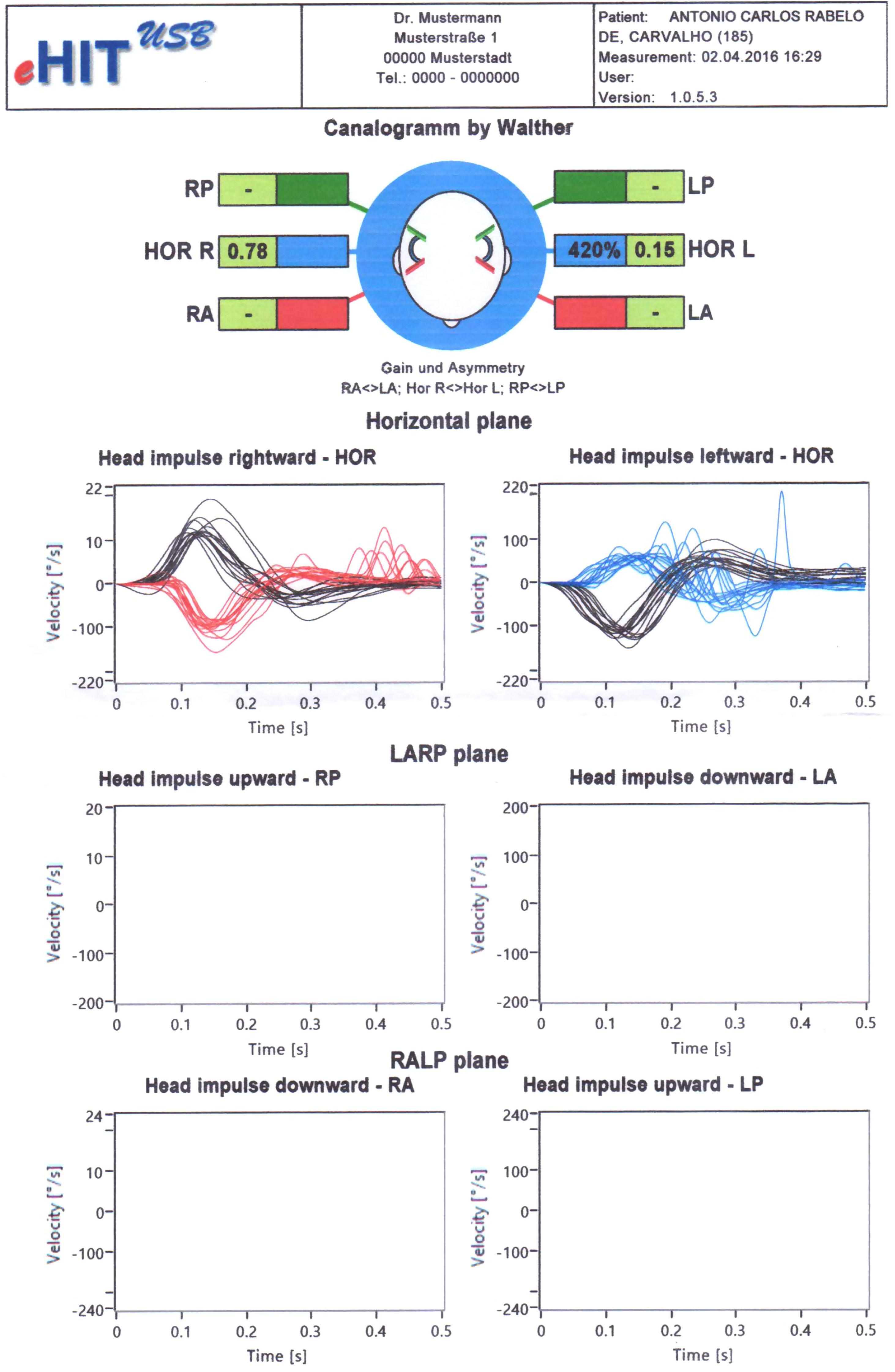 Different cochleovestibular manifestations and outcomes in patients ...