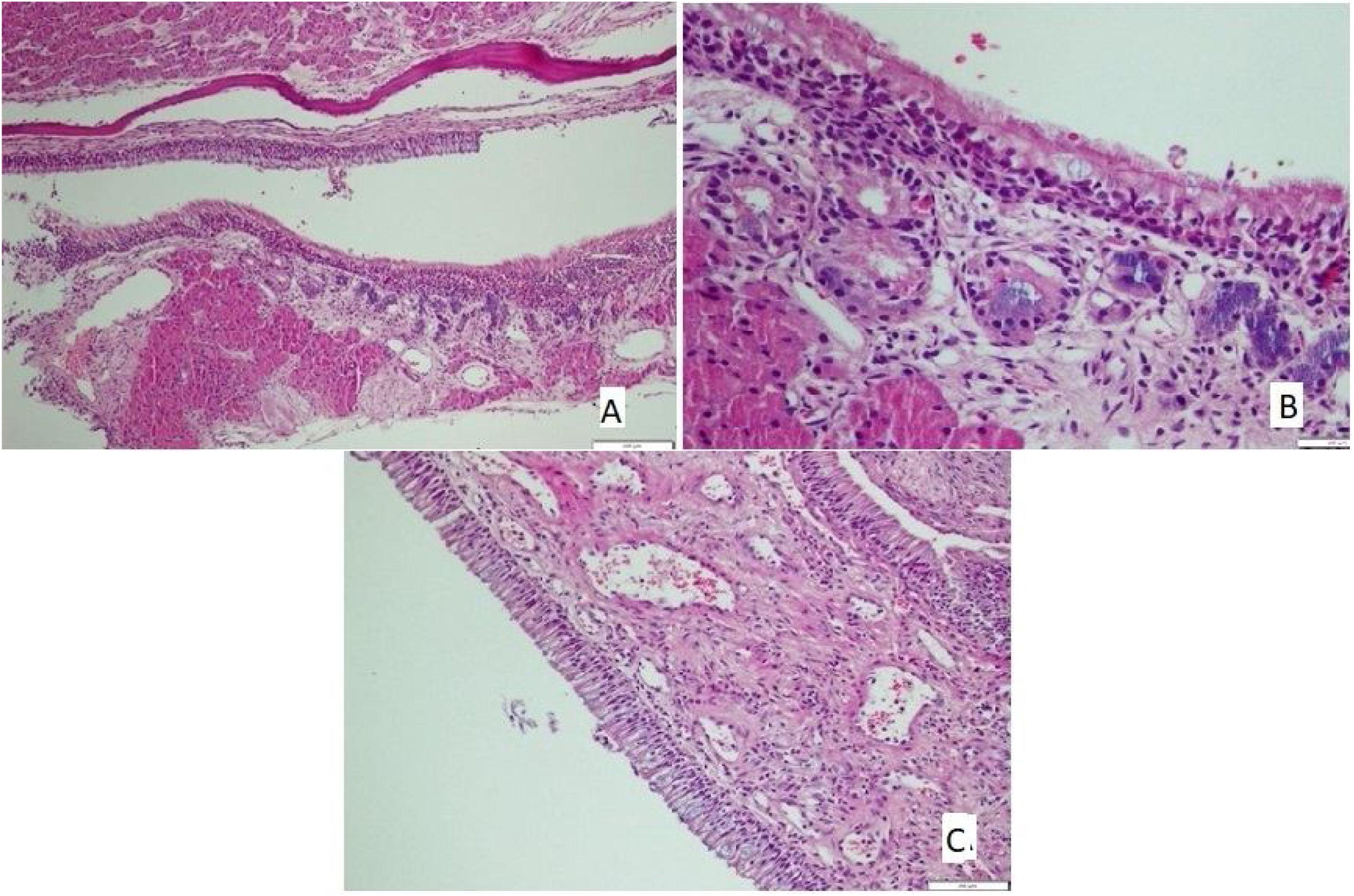 Effects of nigella sativa oil on allergic rhinitis: an experimental ...