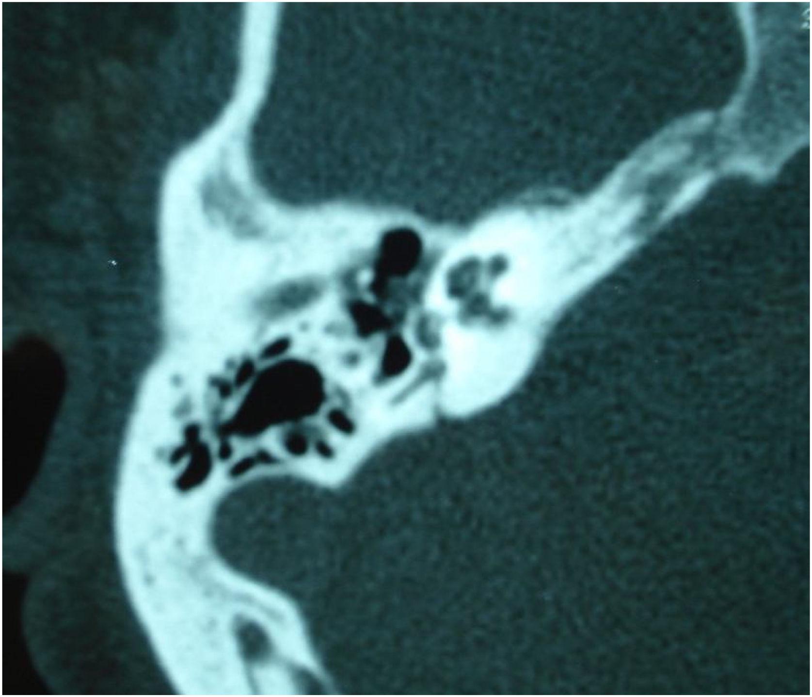 Task force Guideline of Brazilian Society of Otology ‒ hearing loss in ...