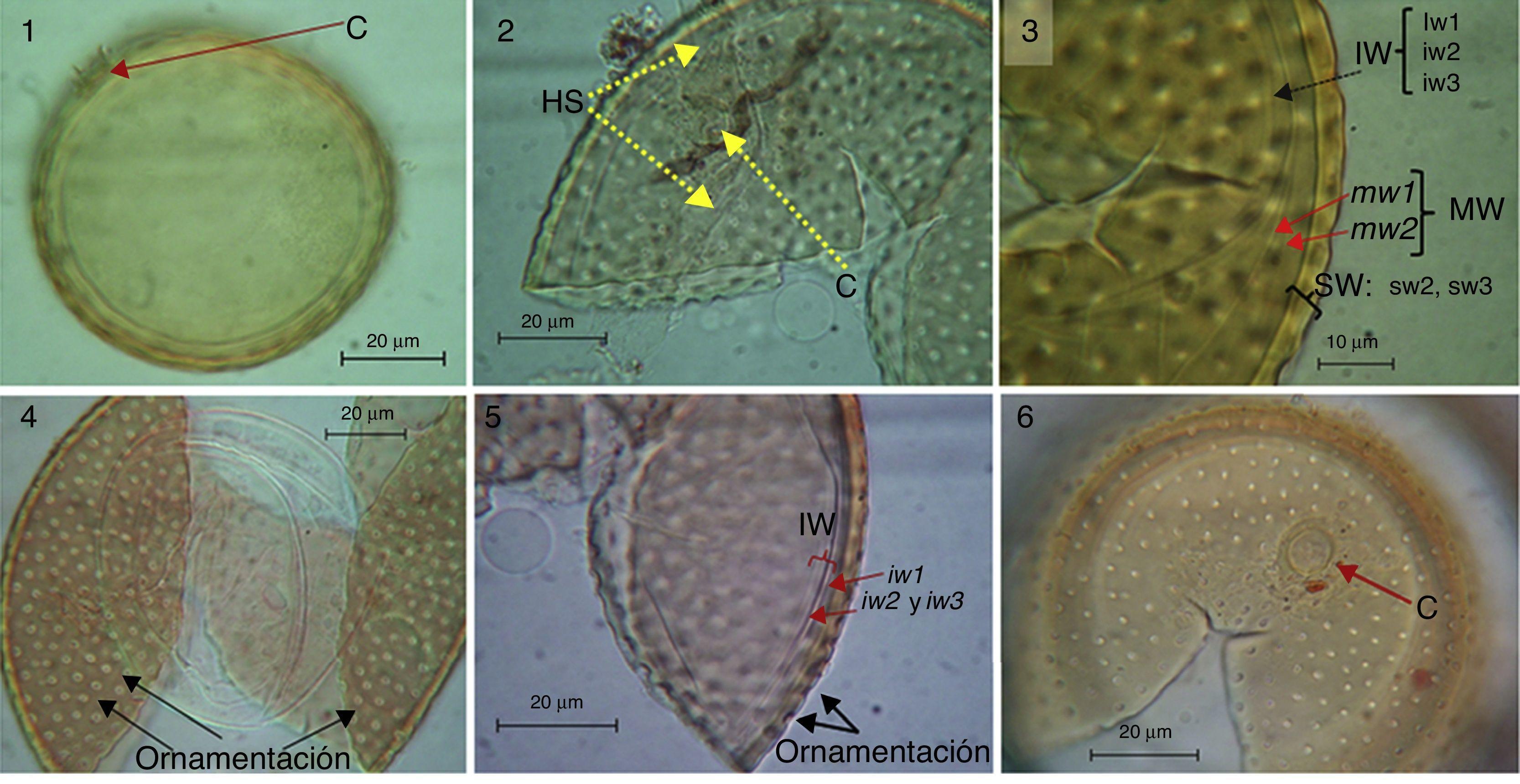 Acaulospora alpina y Ambispora fennica, dos registros nuevos de hongos ...