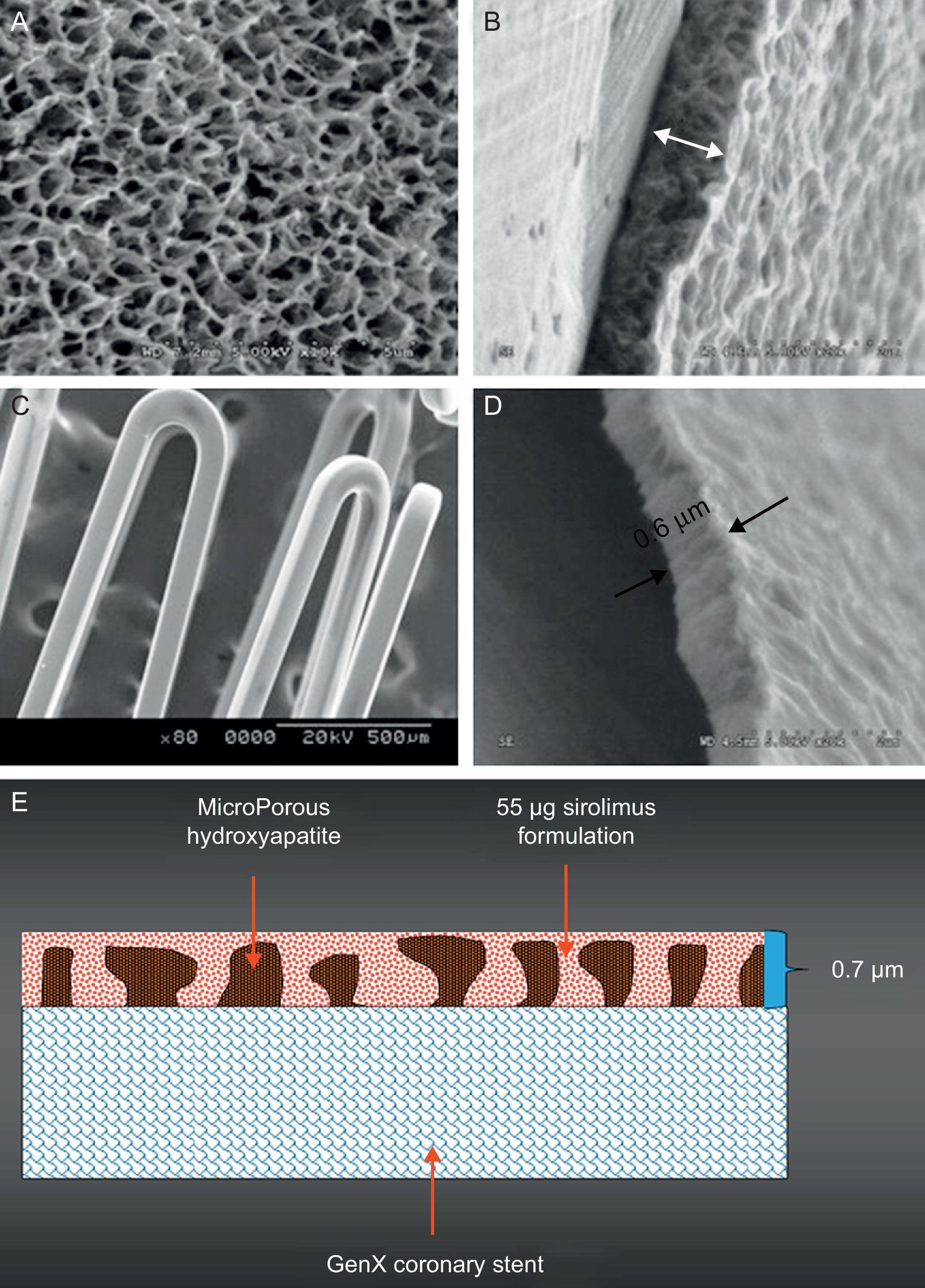 Progress in Treatment by Percutaneous Coronary Intervention: The Stent ...