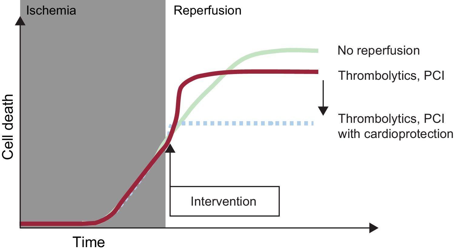 Protection Against Myocardial Ischemia-reperfusion Injury in Clinical ...