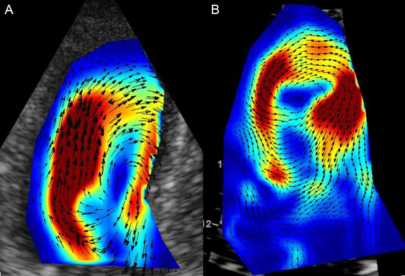 Imaging Techniques in the Evaluation of Post-infarction Function and ...