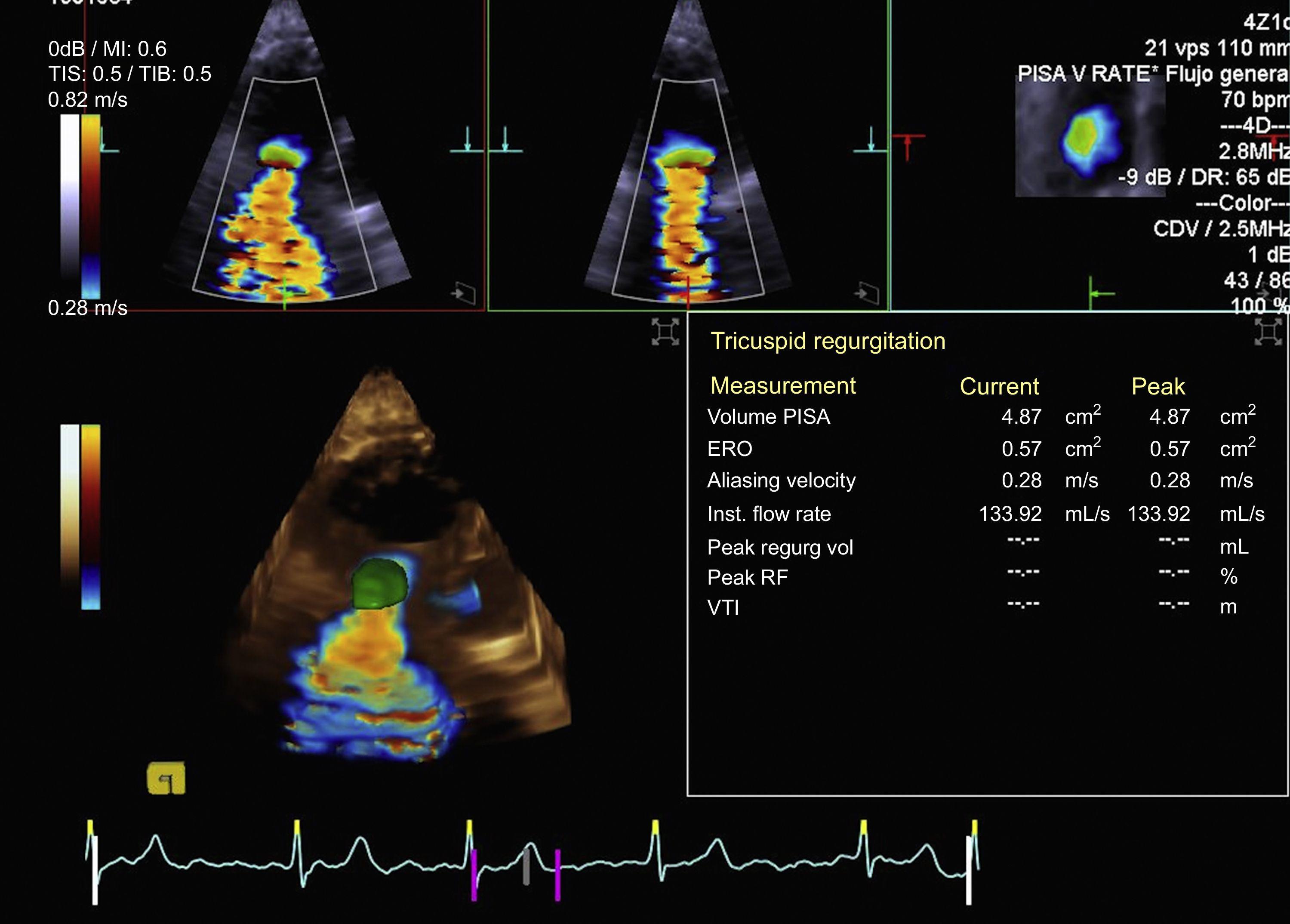 Update on Cardiac Imaging Techniques 2014 | Revista Española de Cardiología