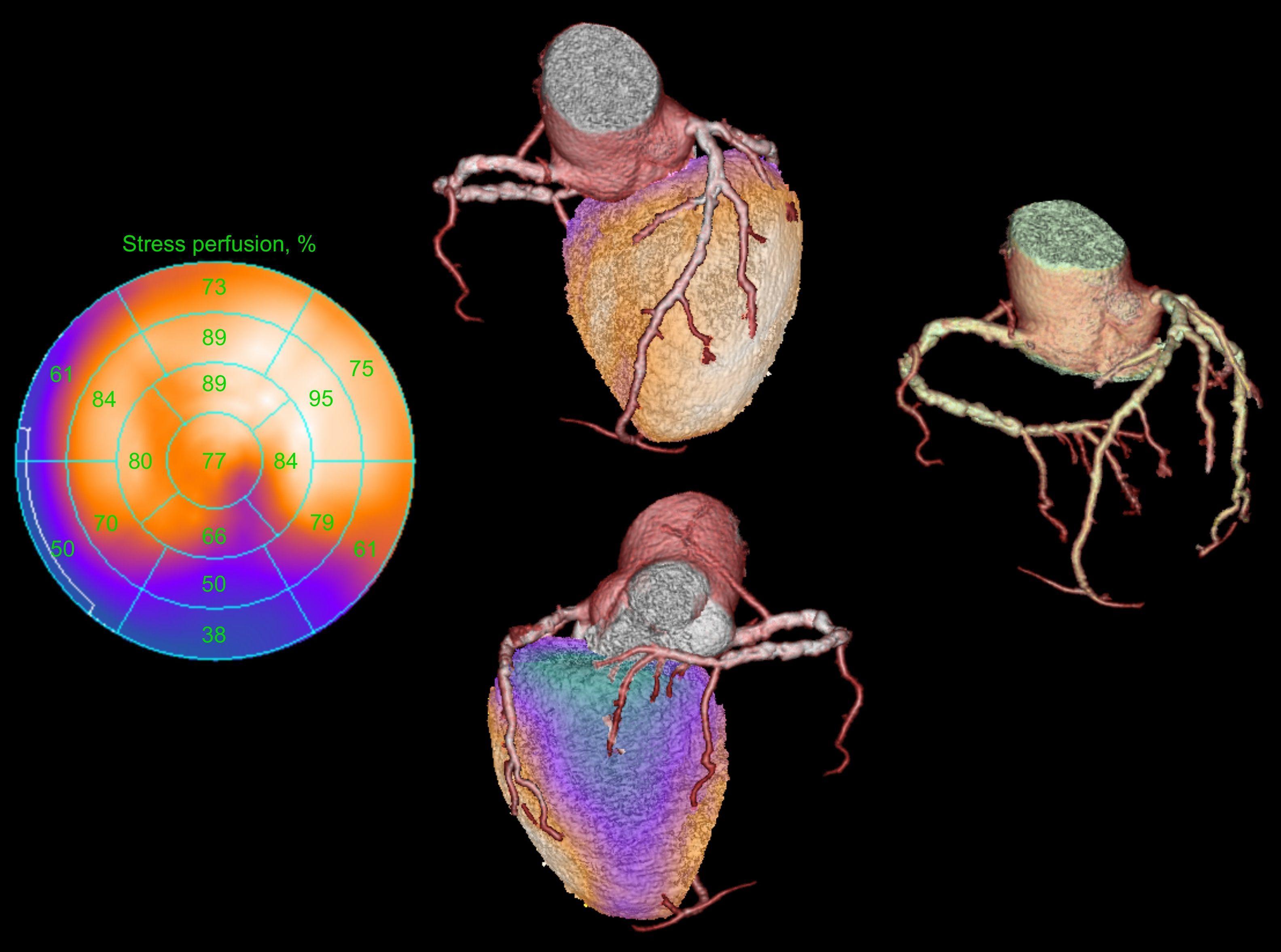 Nuclear Cardiology: Role in the World of Multimodality Cardiac Imaging ...