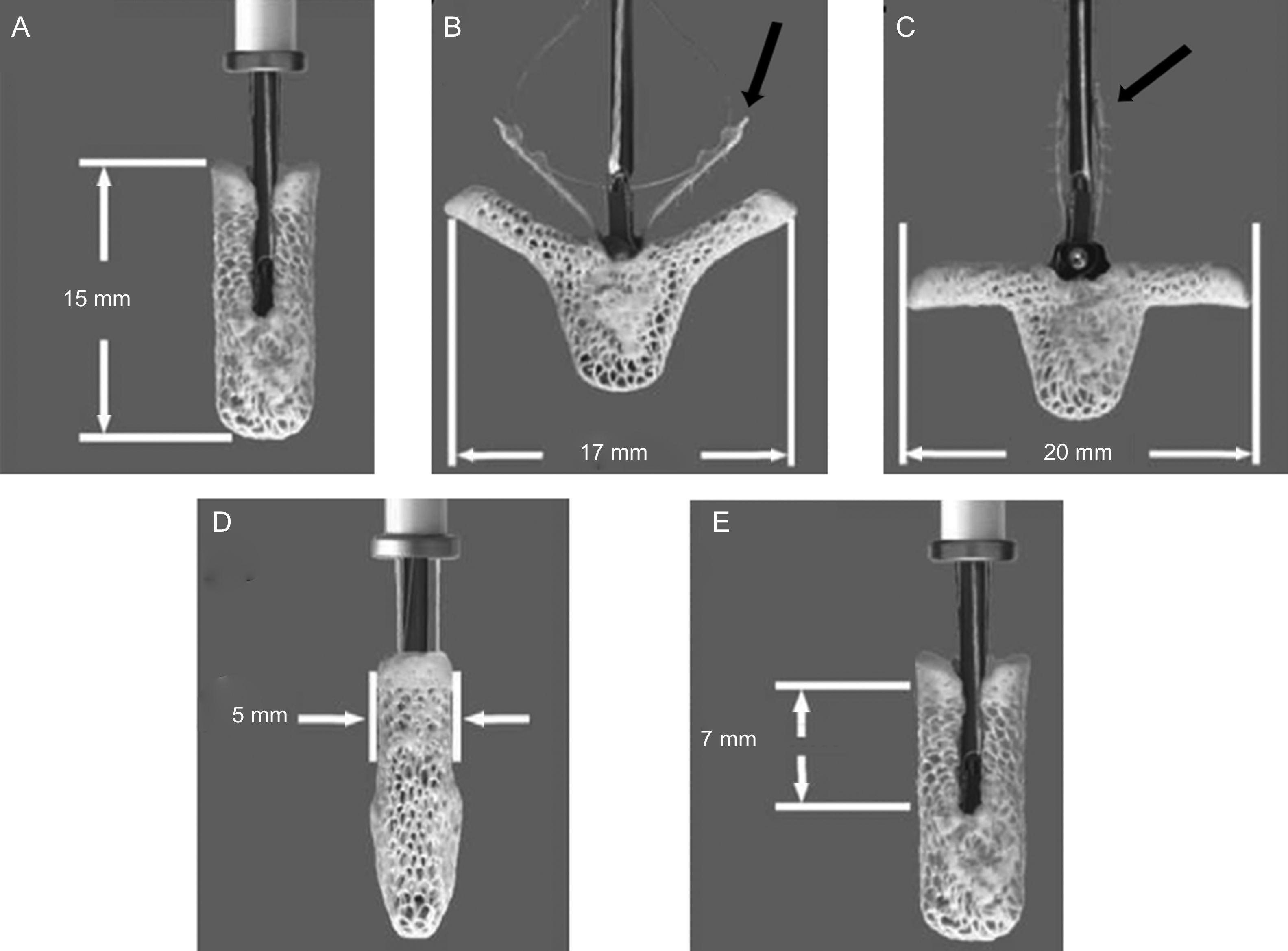 Role of Imaging Techniques in Percutaneous Treatment of Mitral ...