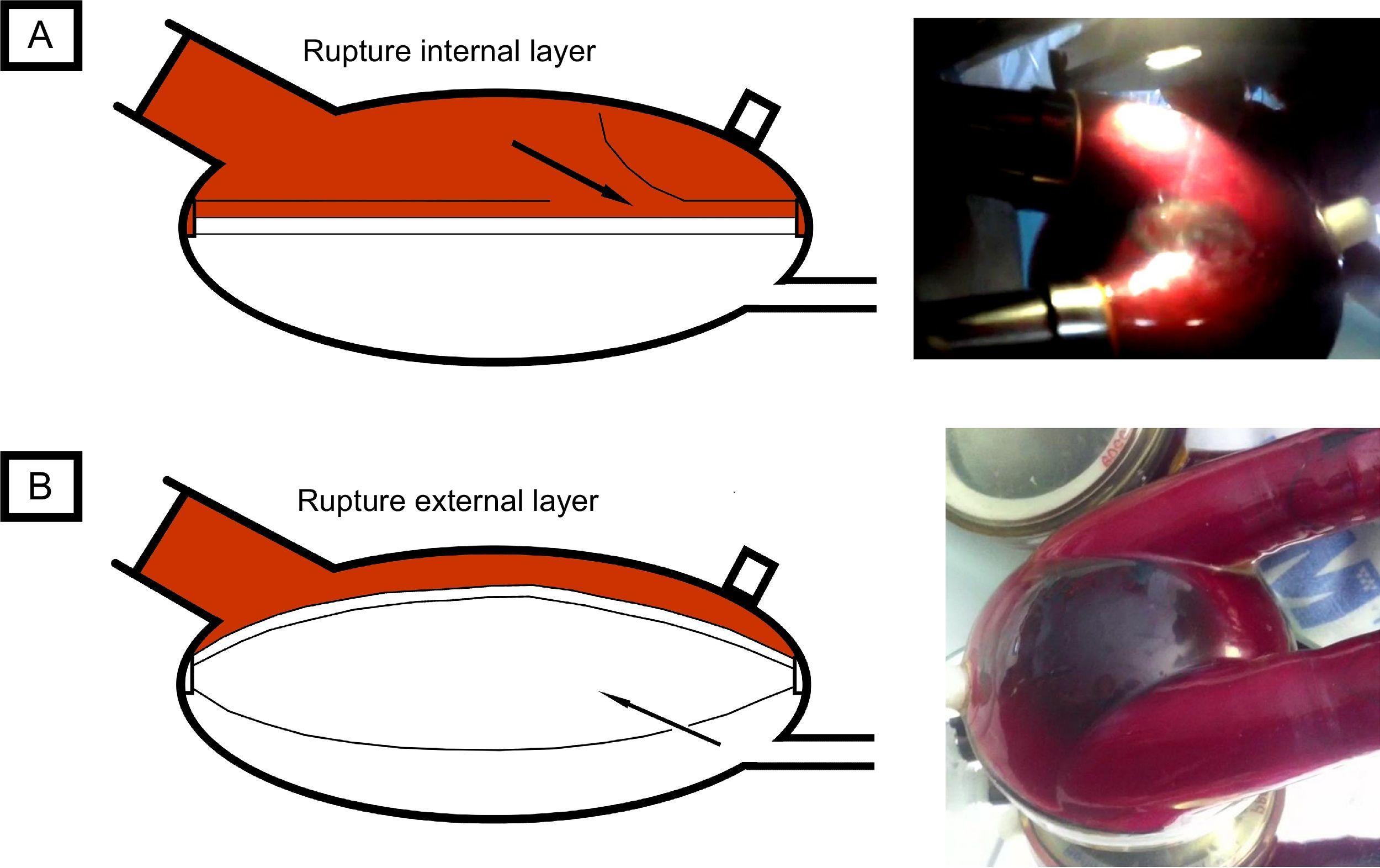 Two Different Sites of Membrane Rupture in the Berlin-Heart EXCOR ...