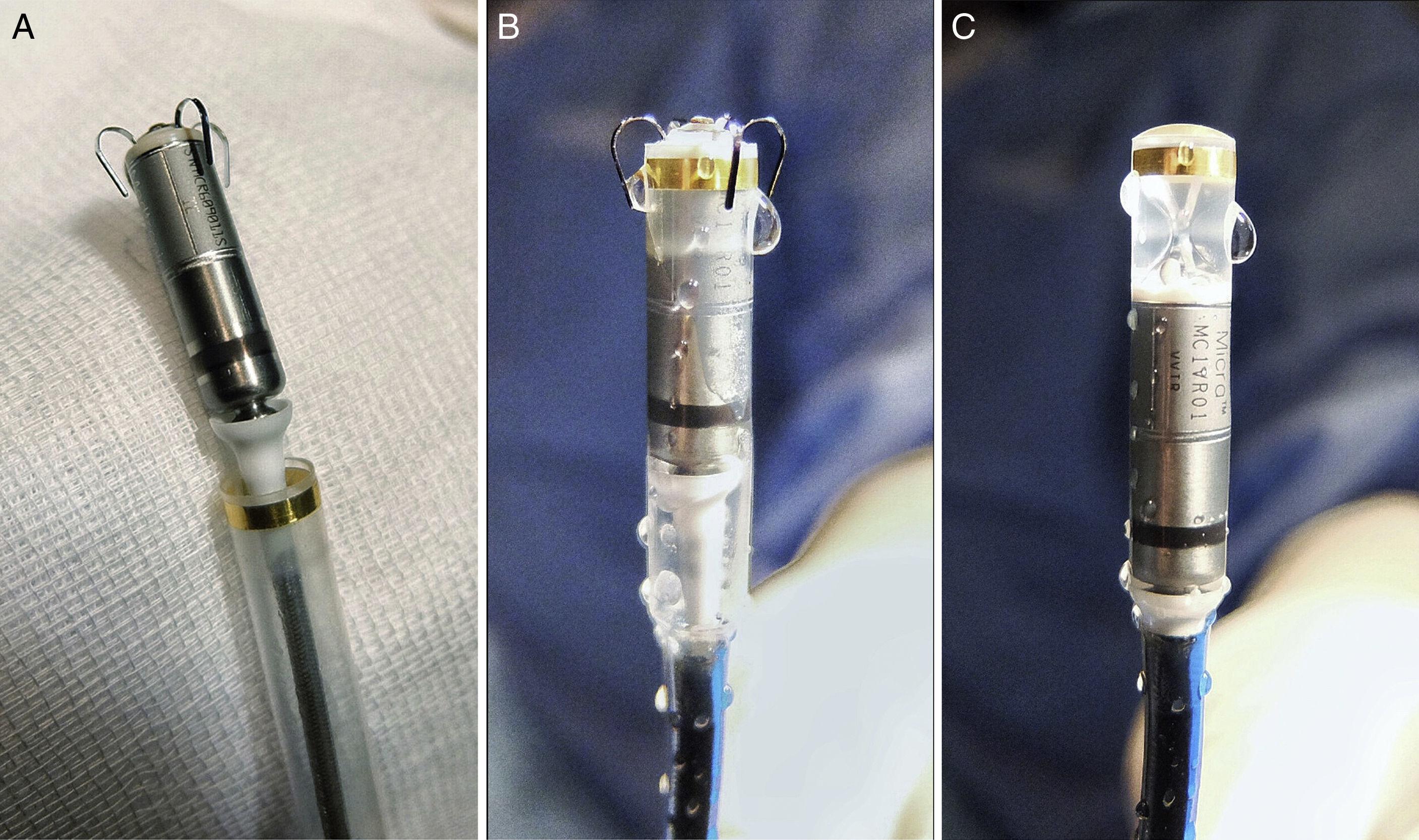 The Micra Leadless Transcatheter Pacemaker. Implantation and Mid-term ...