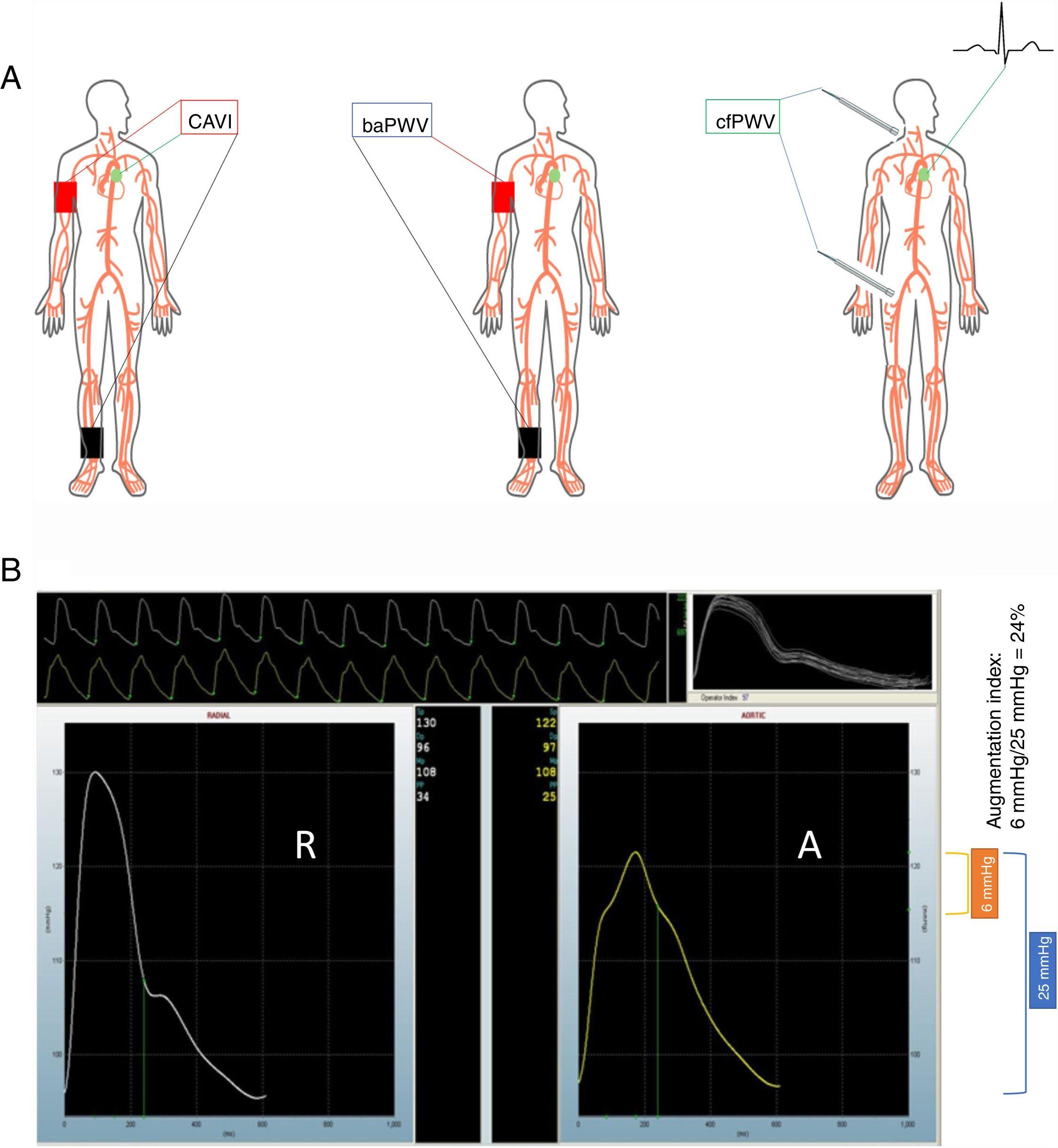 Carotid Pulse Wave