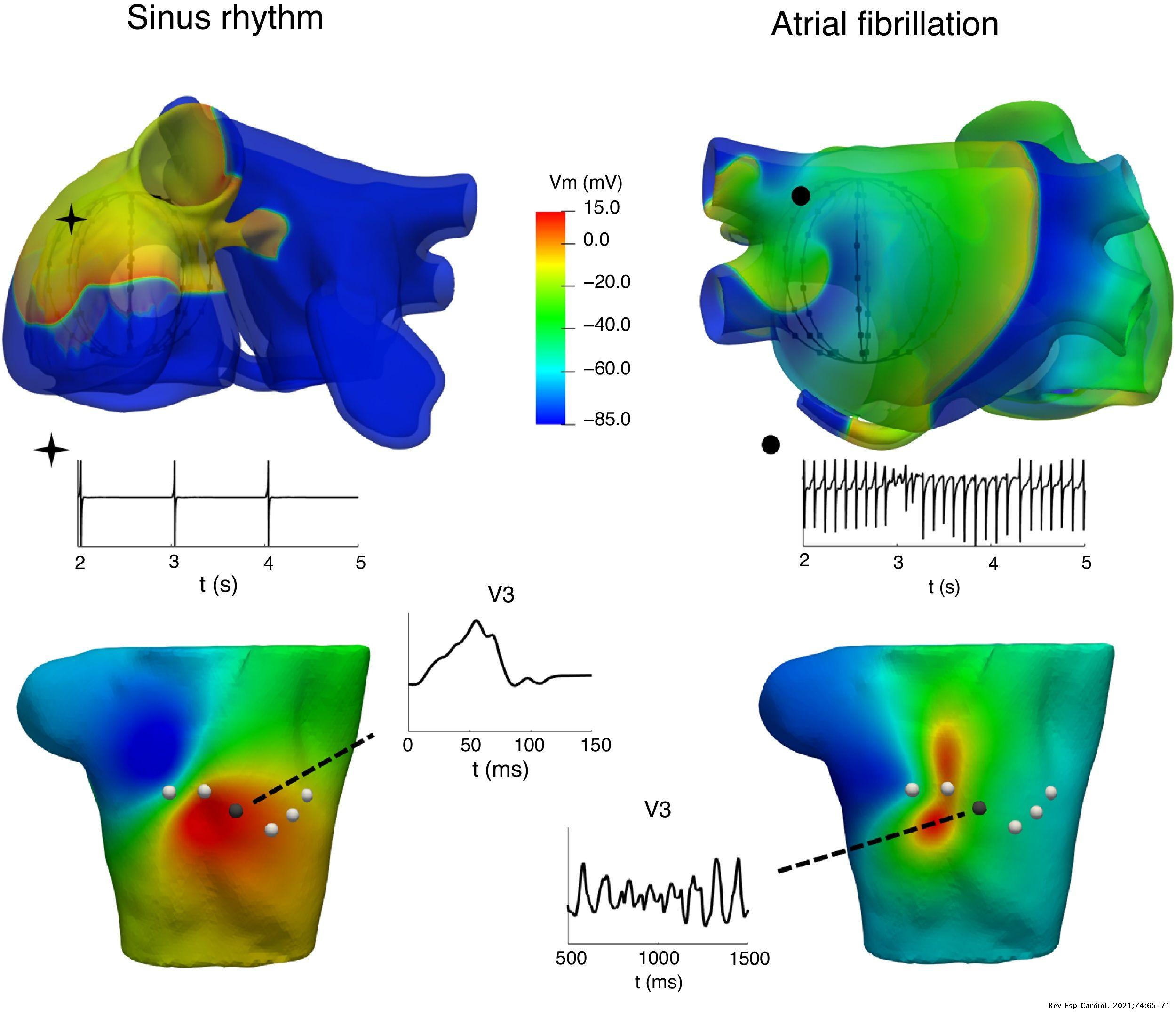 Cardiac Computational Modelling Revista Española De Cardiología