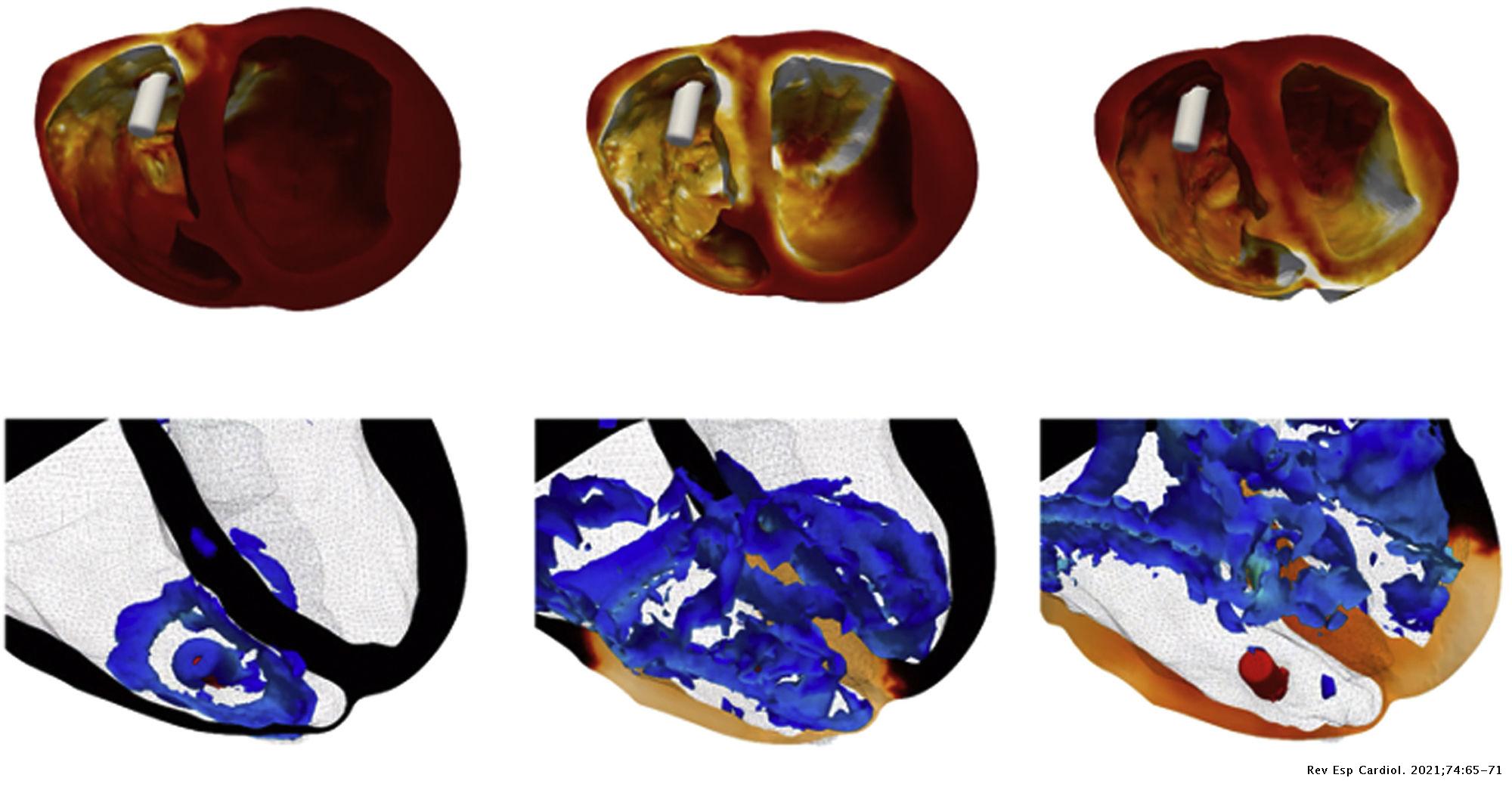 Cardiac Computational Modelling Revista Española De Cardiología