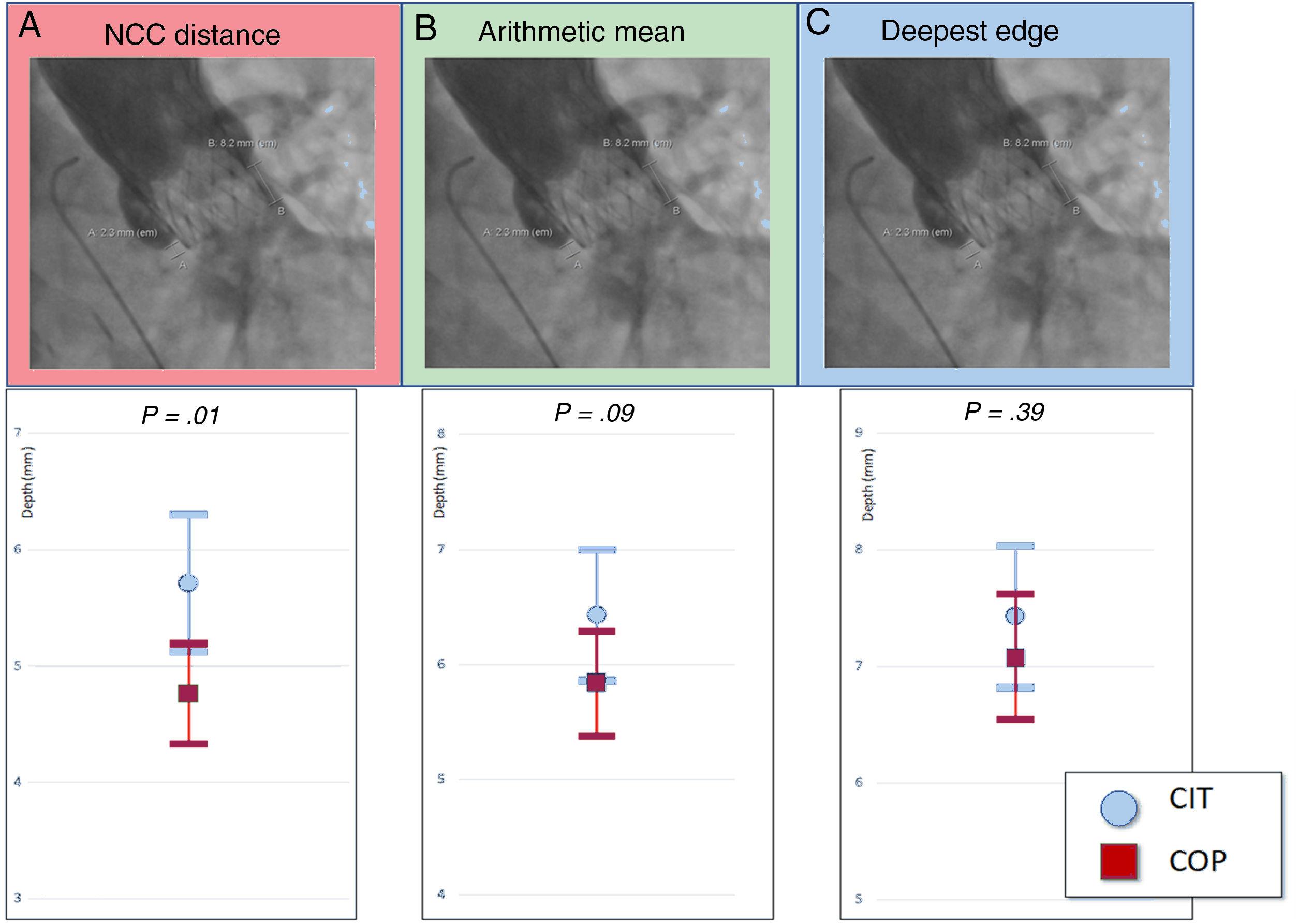 Cusp-overlapping TAVI technique with a self-expanding device optimizes ...