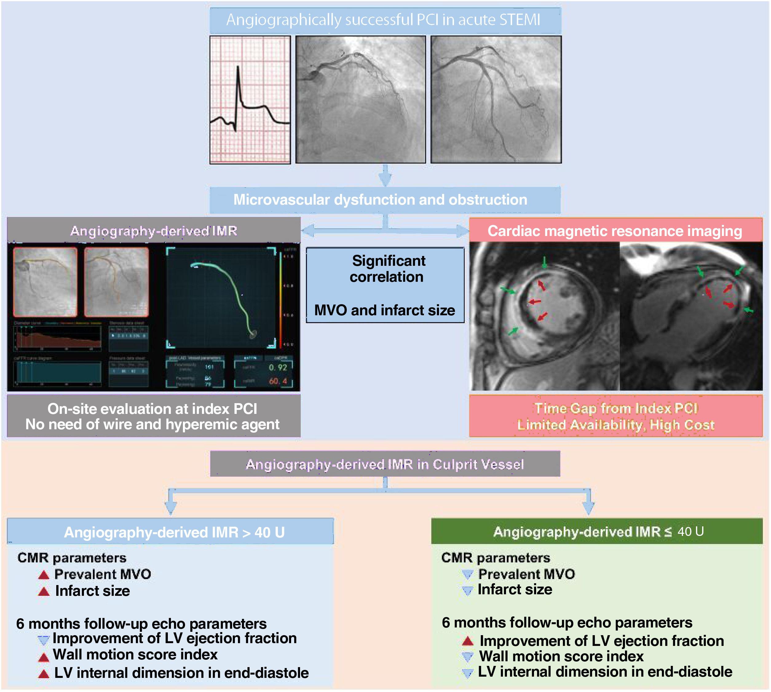 Functional angiography-derived index of microcirculatory resistance ...