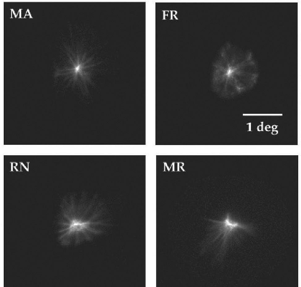 The Optical Design of the Human Eye: a Critical Review | Journal of ...