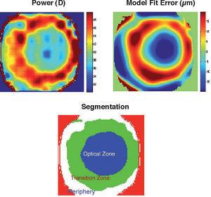 The Optical Design of the Human Eye: a Critical Review | Journal of ...