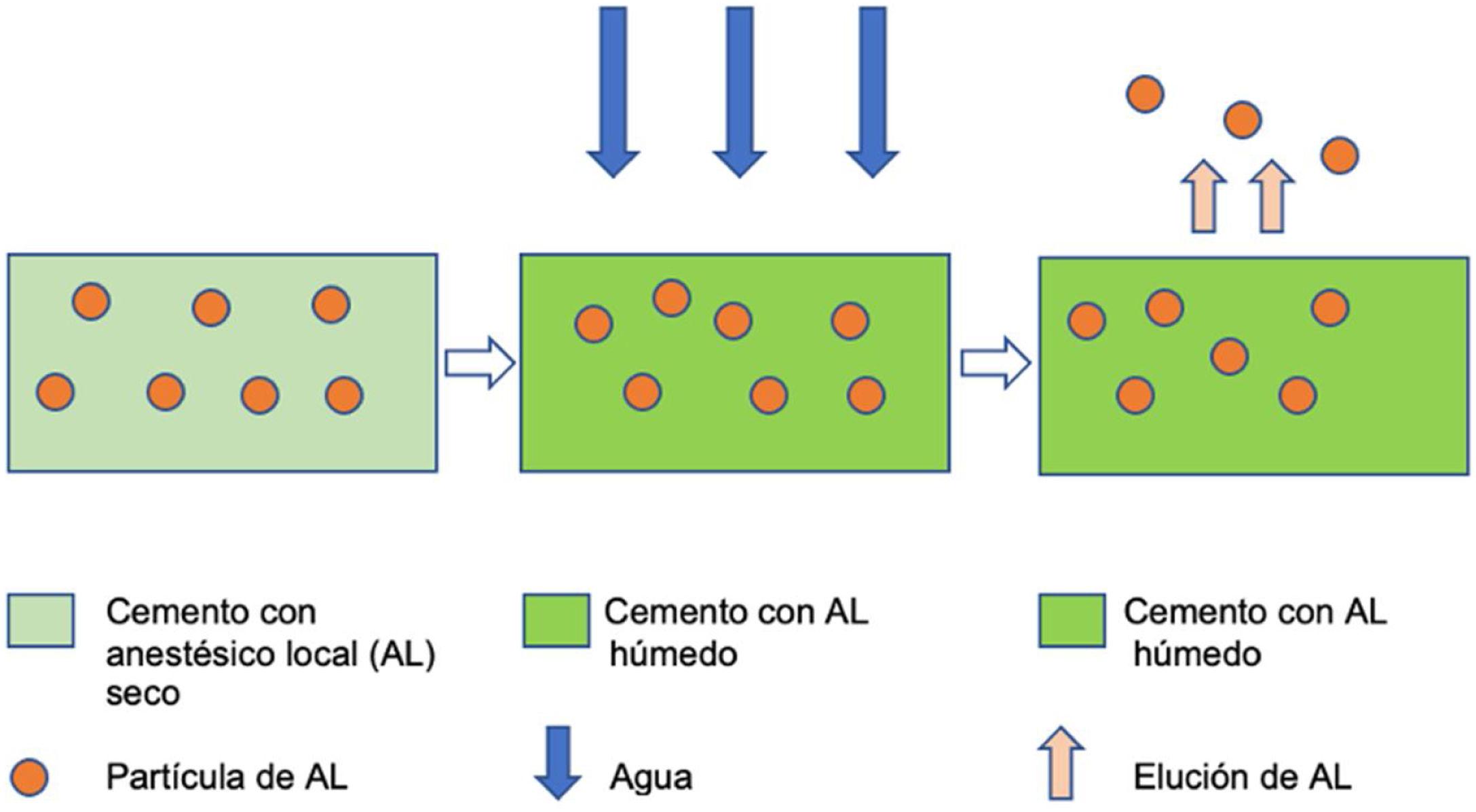 Estudio in vitro de elución de anestésicos locales en cemento óseo de ...