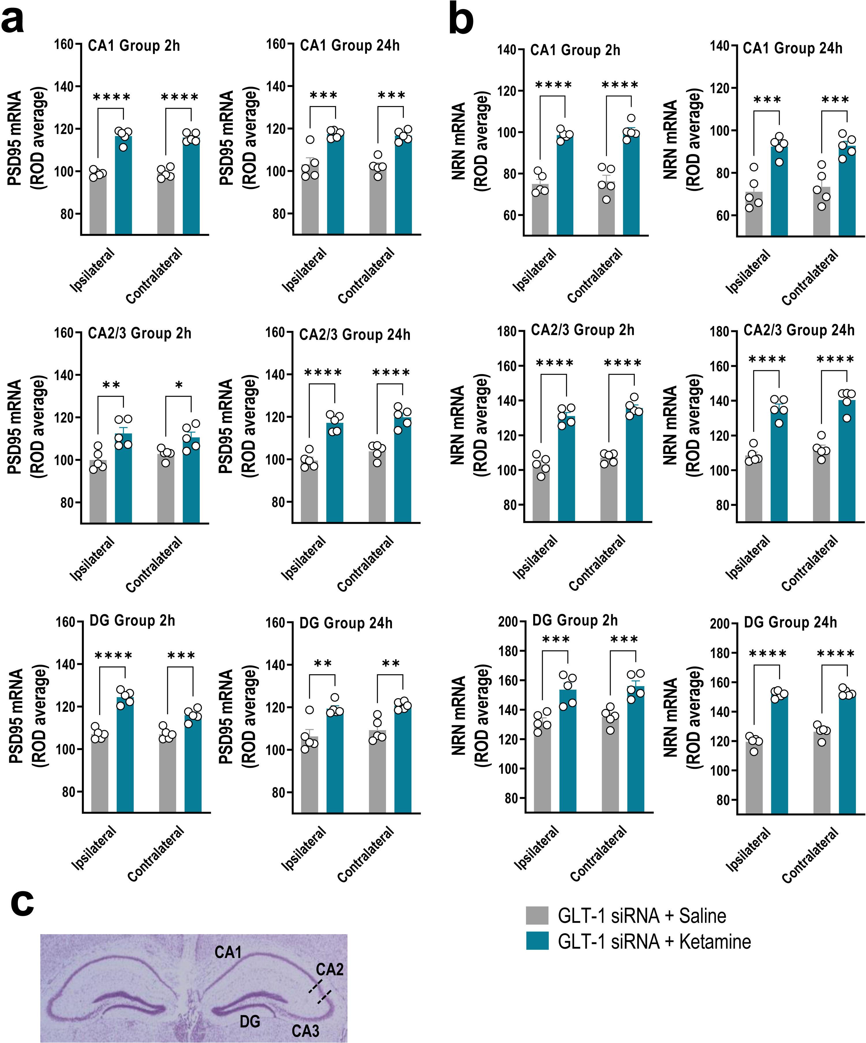 Ketamine triggers rapid antidepressant effects by modulating synaptic ...