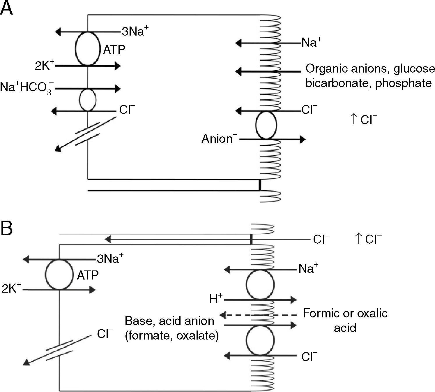 Hyperchloremia – Why and how | Nefrología
