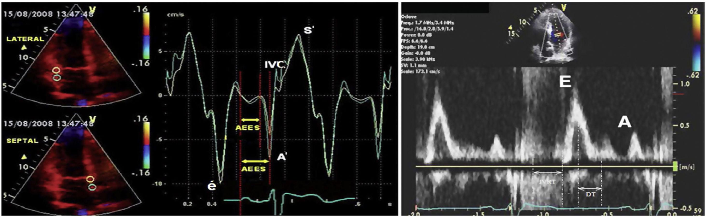 A new technique for the detection of dry weight in hemodialysis ...