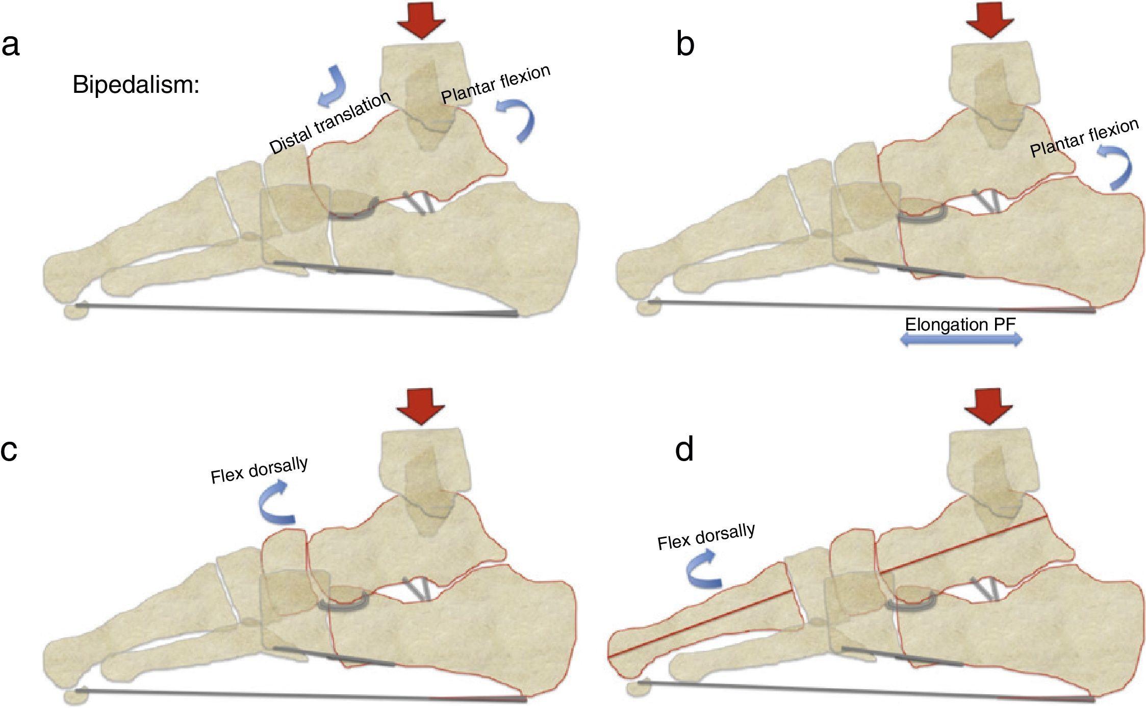 Posterior tibial tendon dysfunction: What other structures are involved ...
