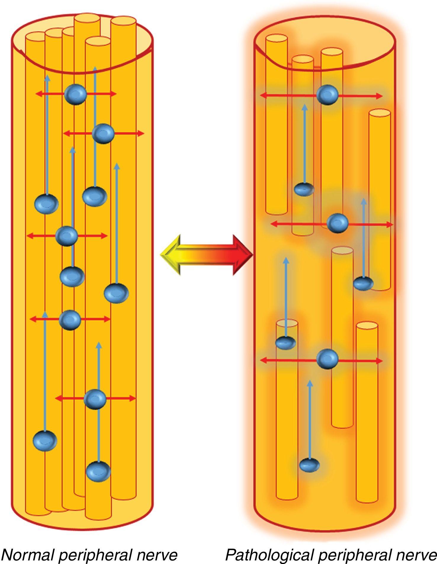 Update in the evaluation of peripheral nerves by MRI, from morphological to functional ...