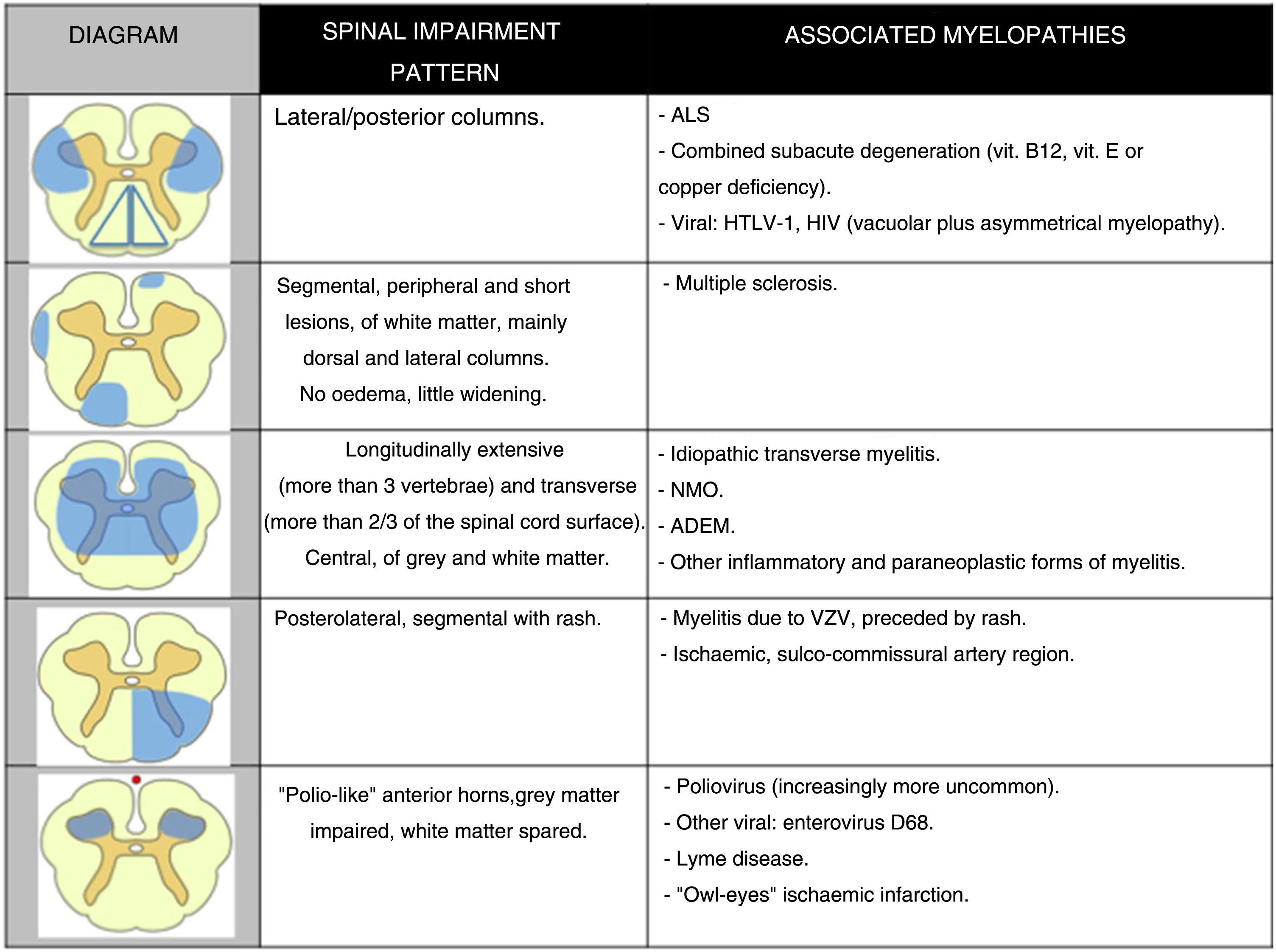Clinical-radiological approach to nontraumatic myelopathy | Radiología ...