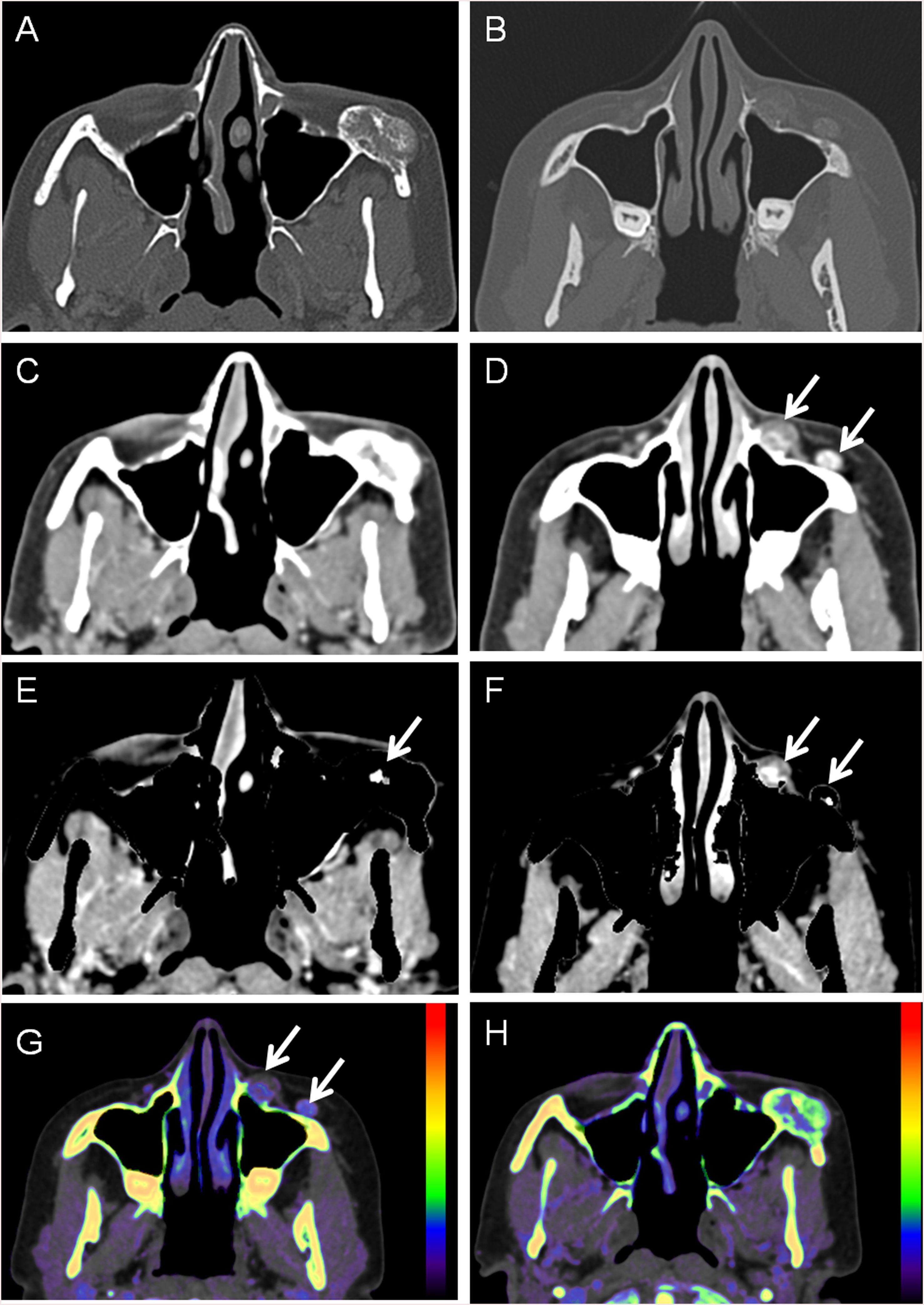 Strengths, weaknesses, opportunities, and threat analysis of dual ...