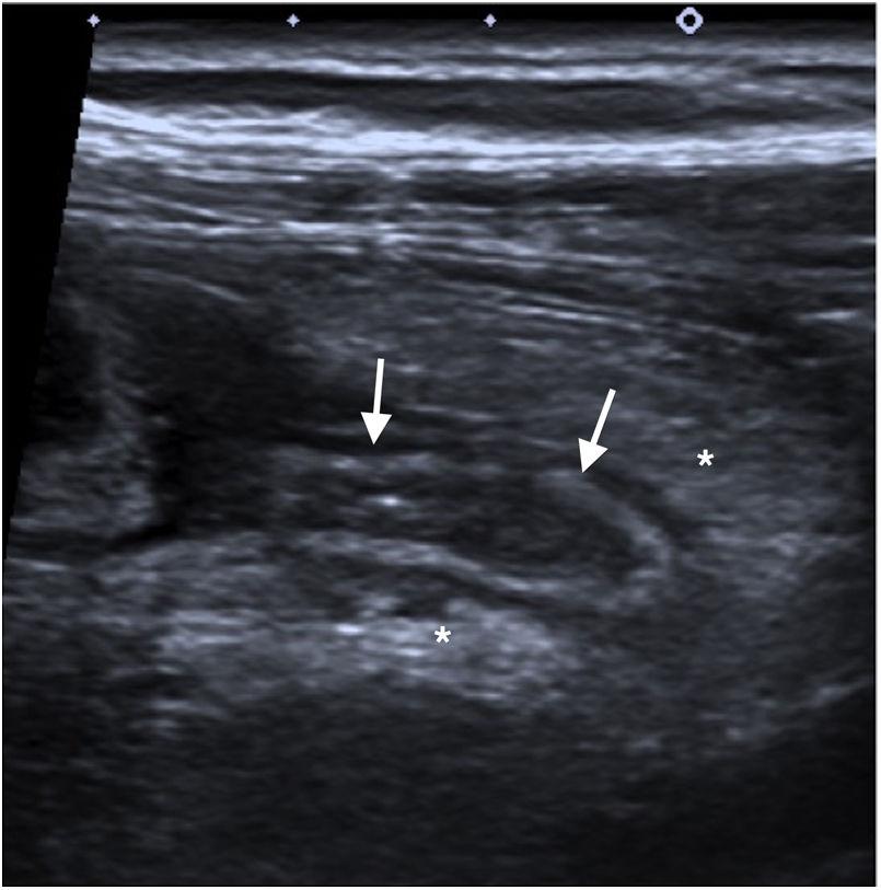 The usefulness and positive predictive value of ultrasonography and ...