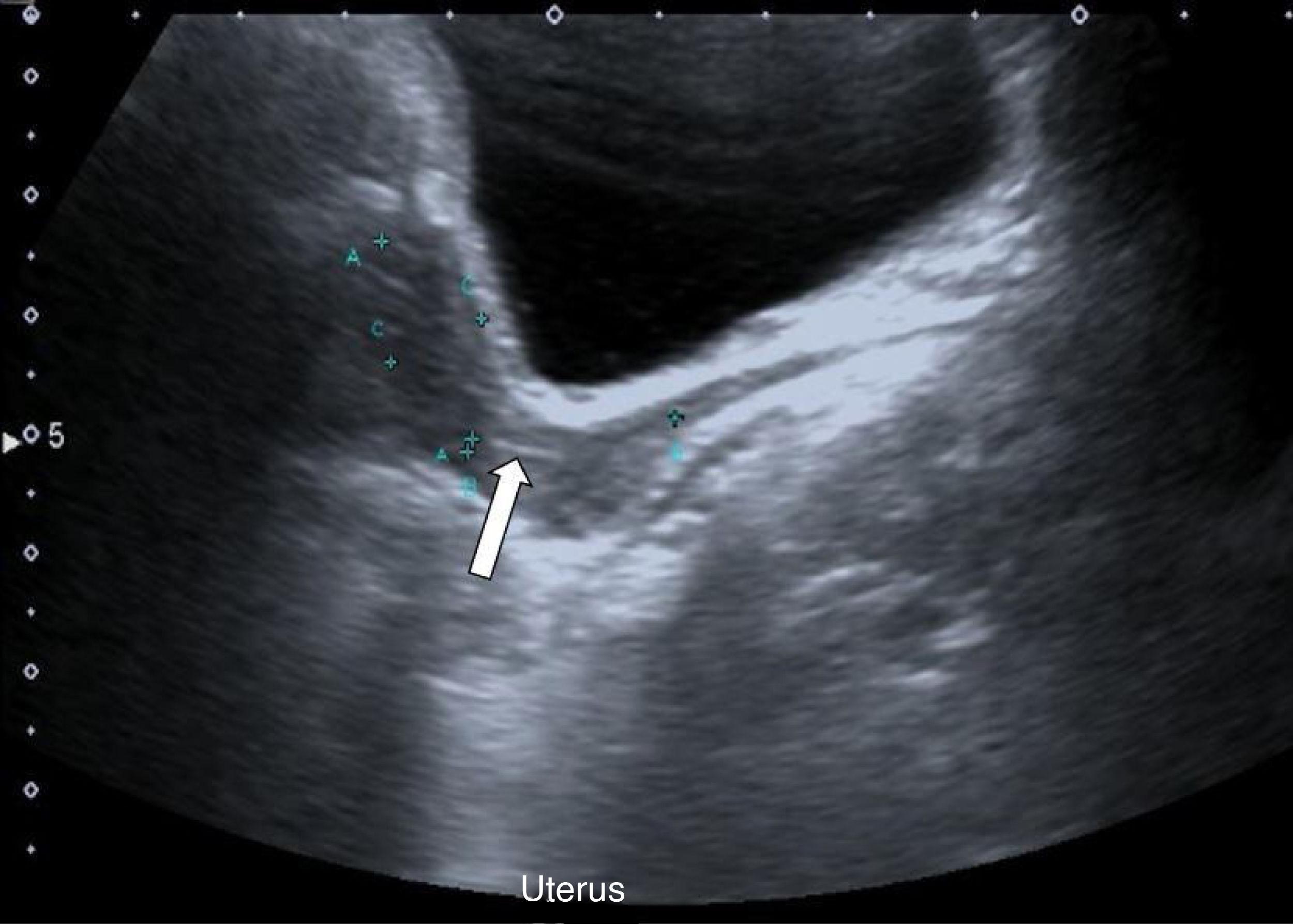 Correlation between imaging findings and hormonal markers at the onset ...