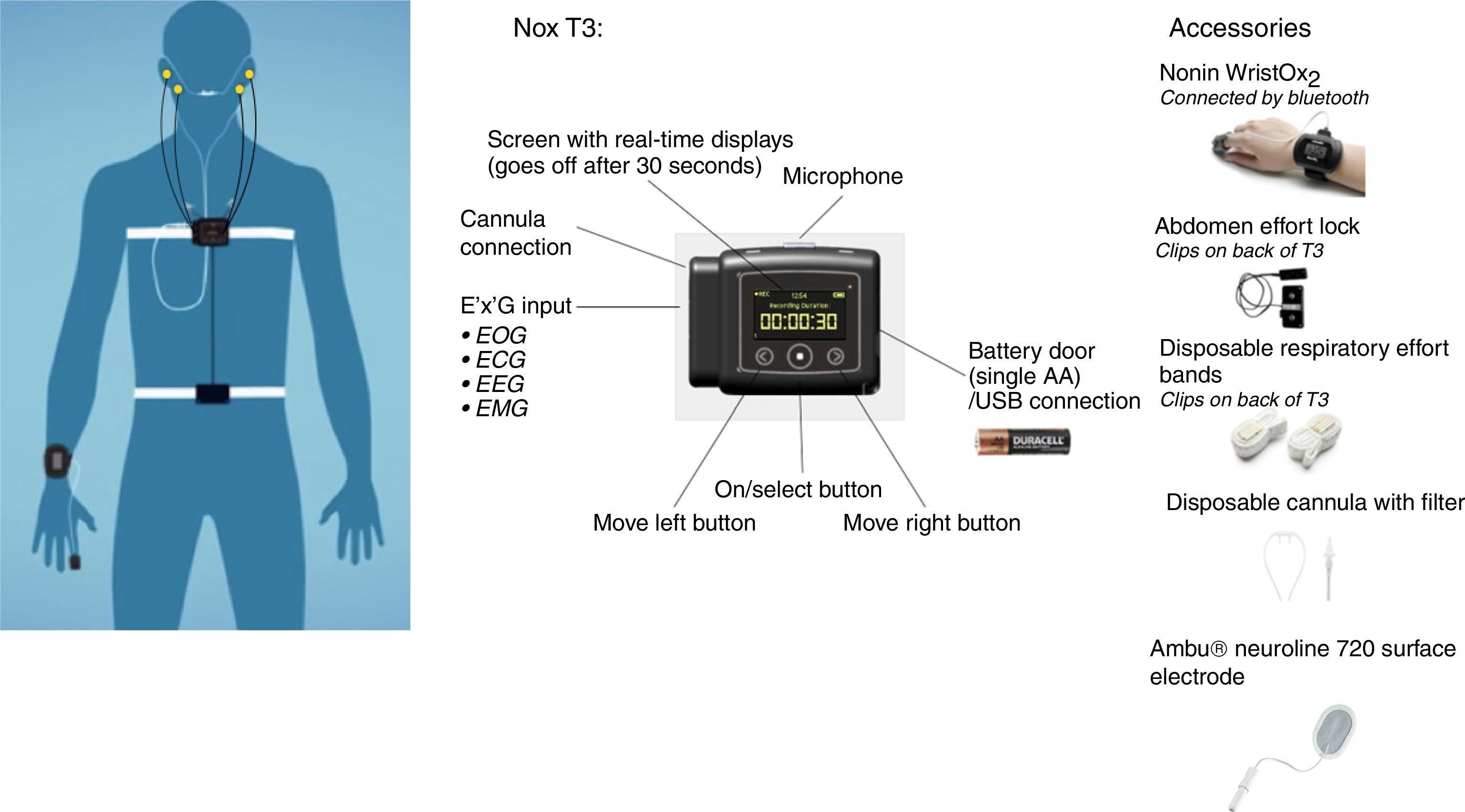 Sleep bruxism associated with obstructive sleep apnoea syndrome – A ...