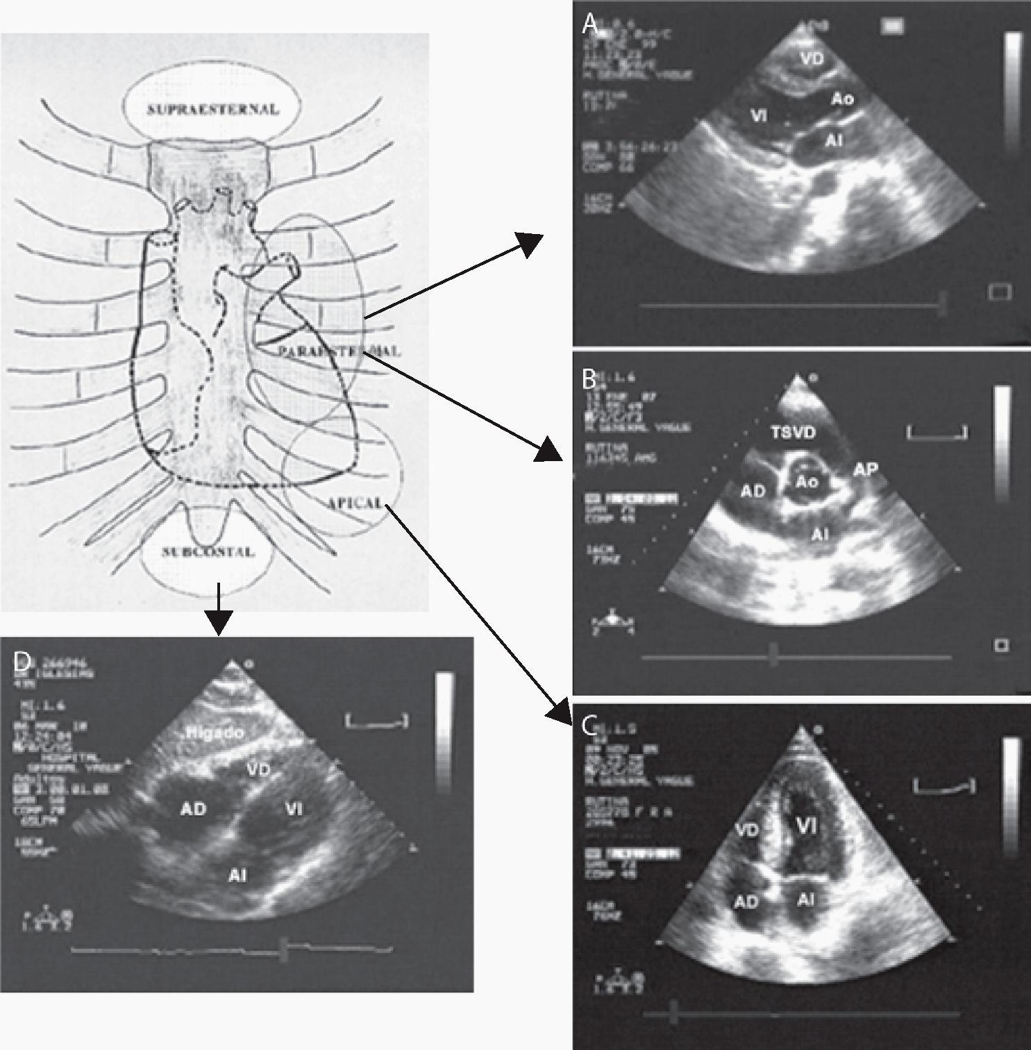 Role of echocardiography in the hemodynamic monitorization of critical ...