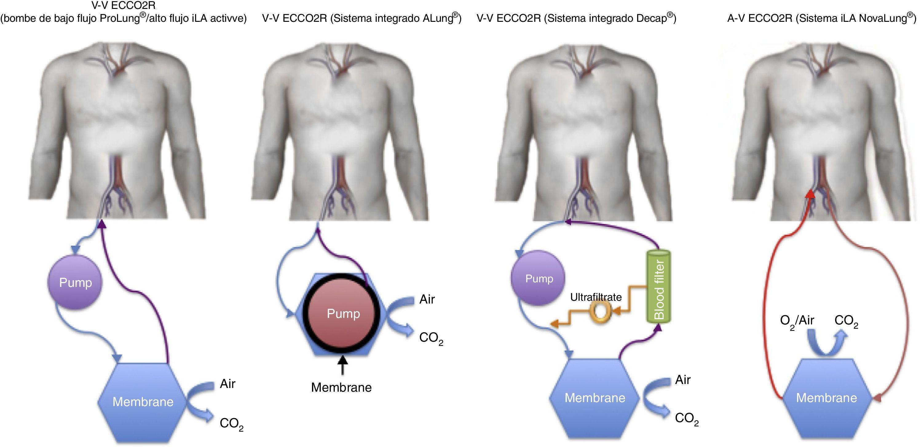 Extracorporeal CO2 removal: Technical and physiological fundaments and ...
