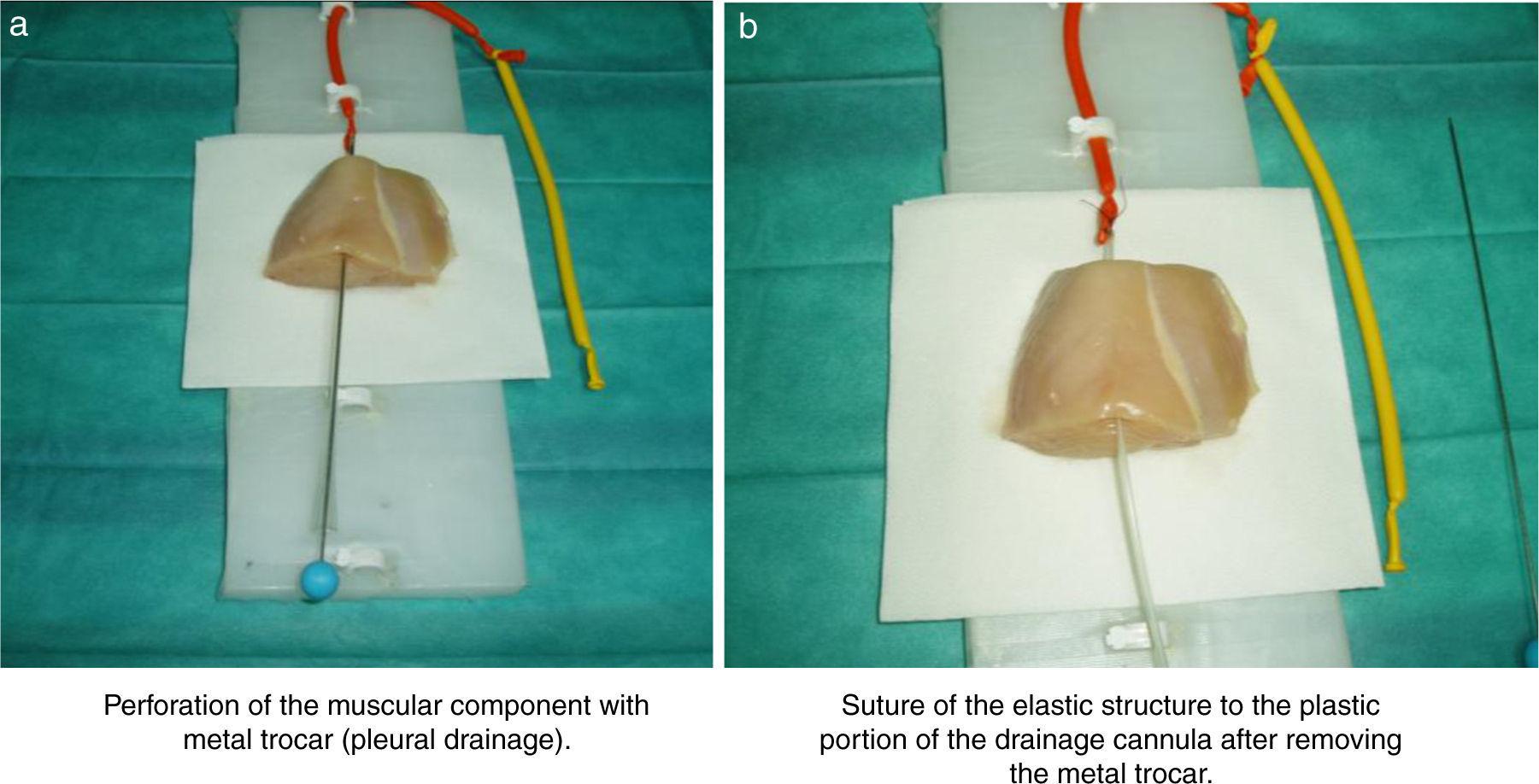Design and application of model for training ultrasound-guided vascular ...