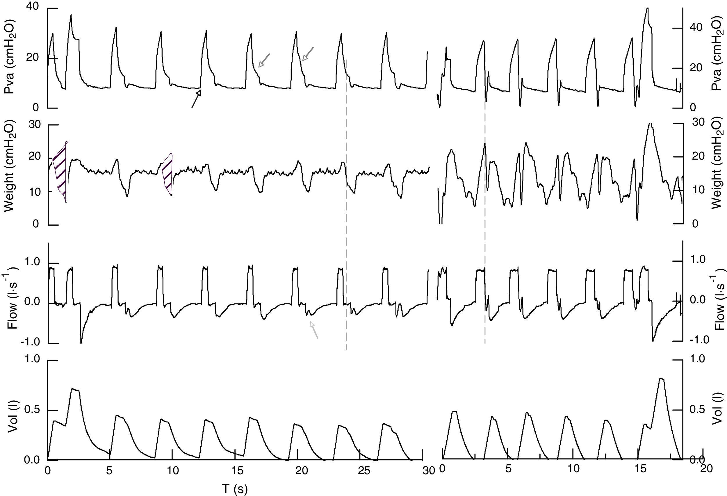 Trigger reverse identification in critical care setting | Medicina ...