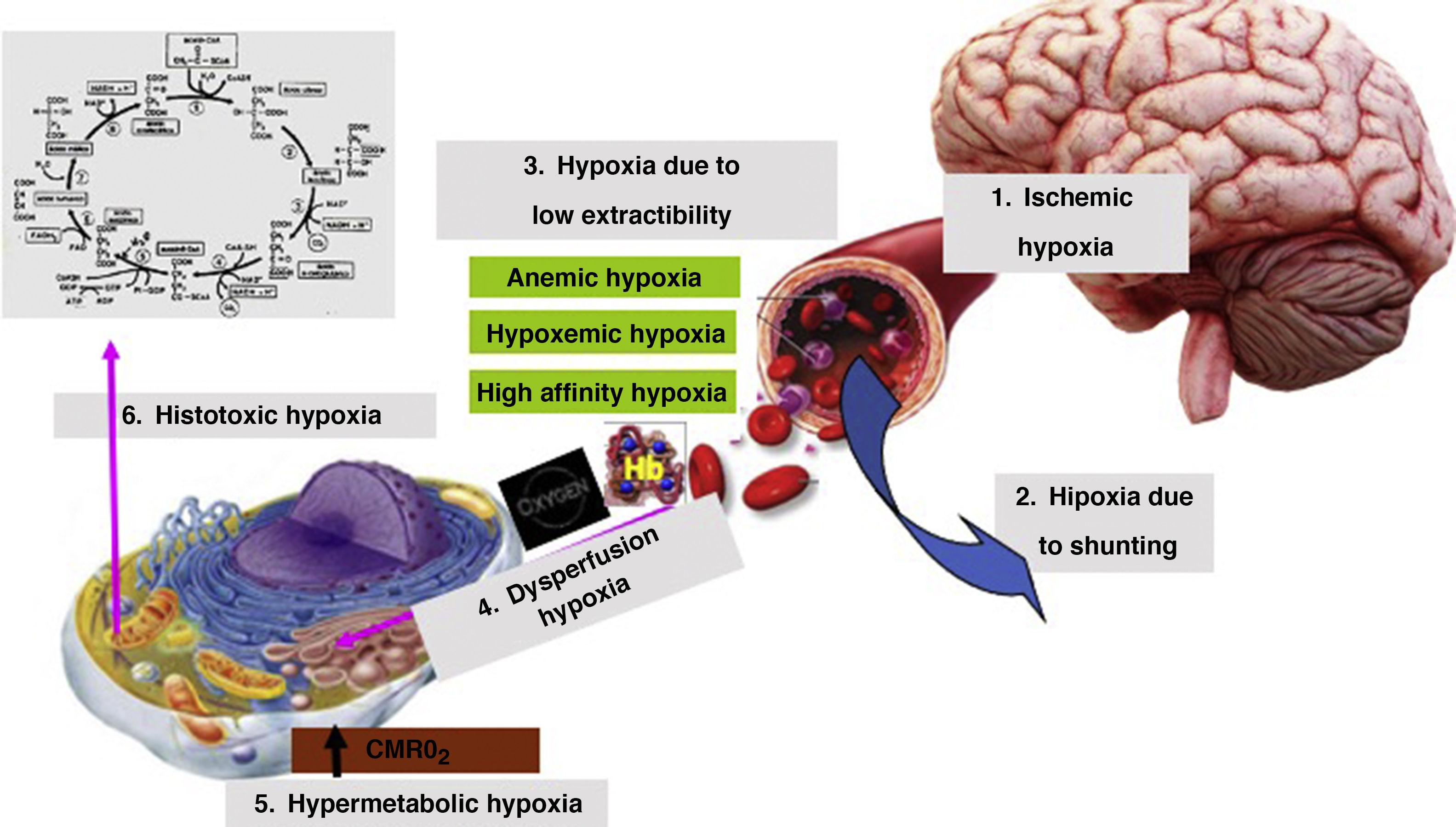Trigger transfusion in severe traumatic brain injury | Medicina Intensiva